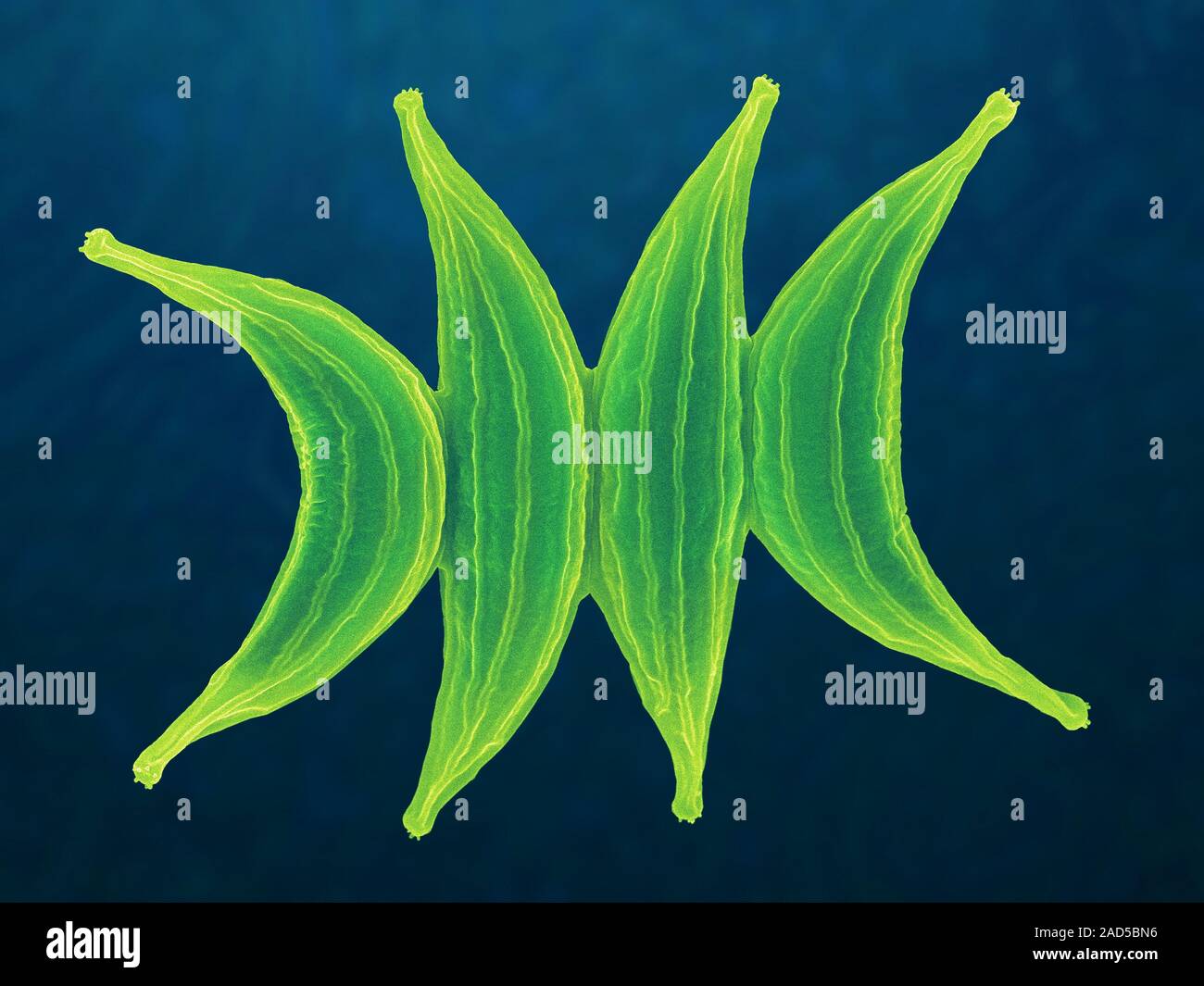 Coloured scanning electron micrograph (SEM) of Scenedesmus spp., flat ...