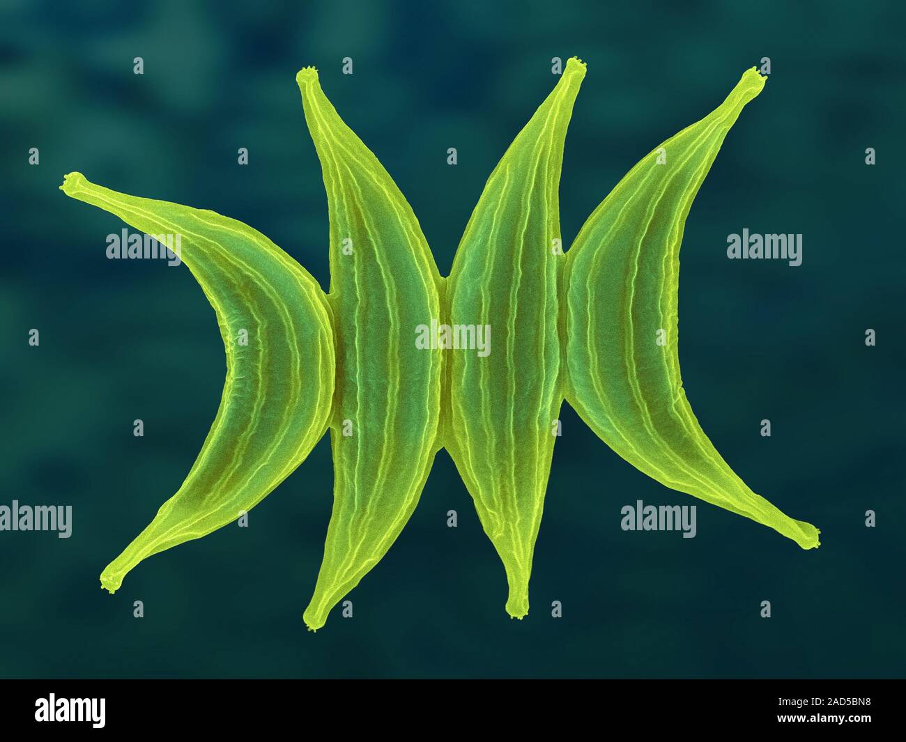 Coloured scanning electron micrograph (SEM) of Scenedesmus spp., flat ...