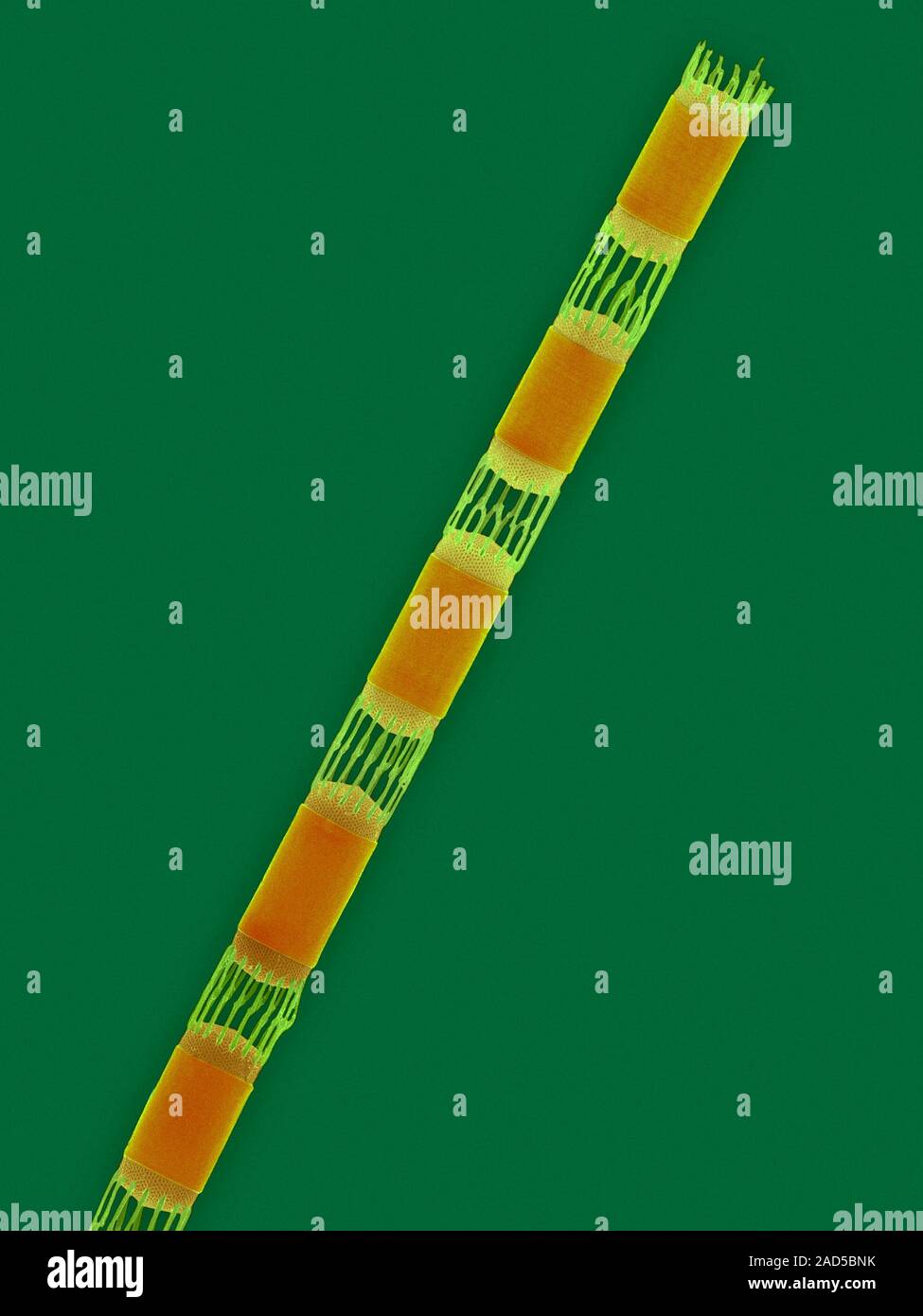 Coloured scanning electron micrograph (SEM) of marine, filamentous ...
