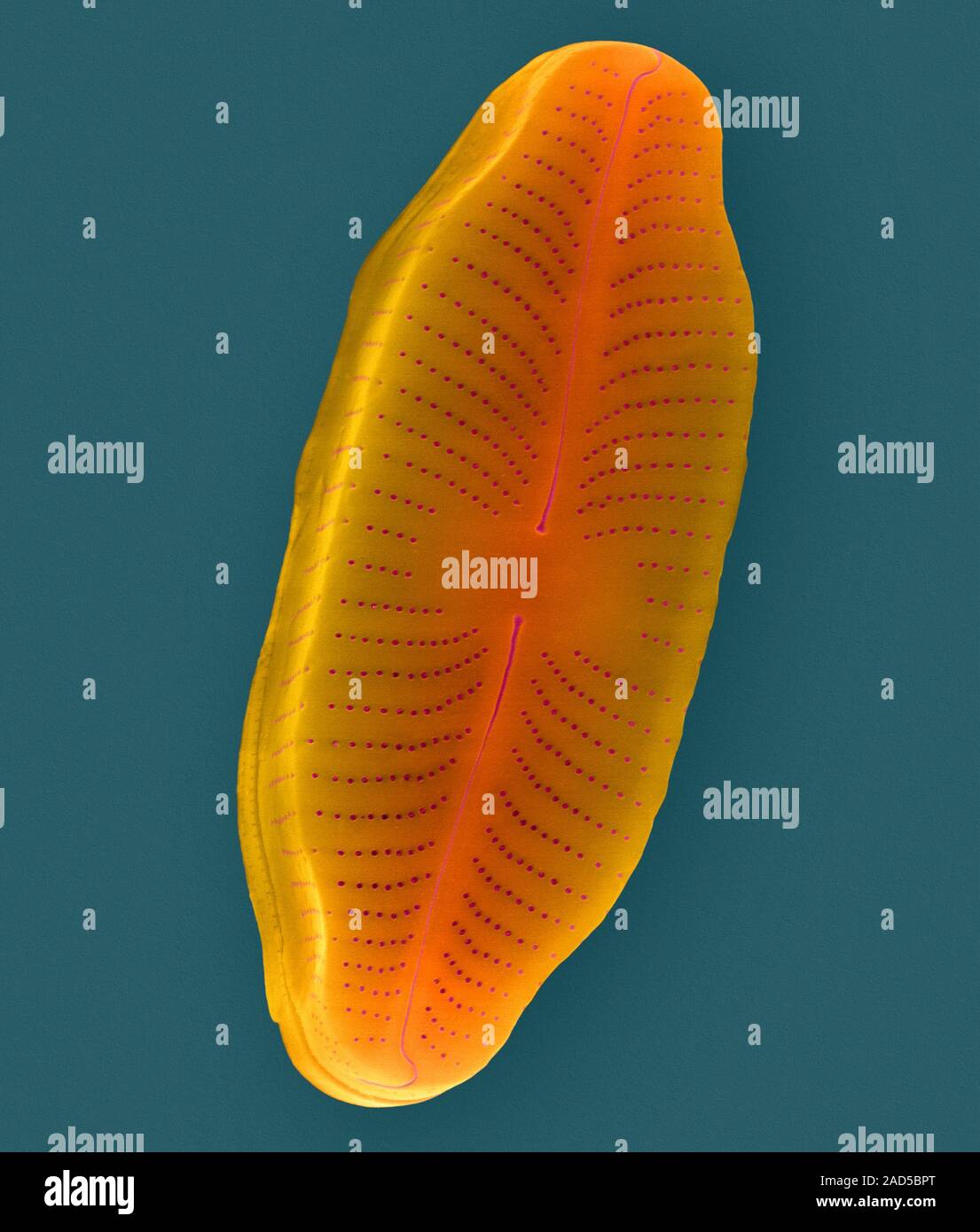 Coloured scanning electron micrograph (SEM) of moist soil pennate ...
