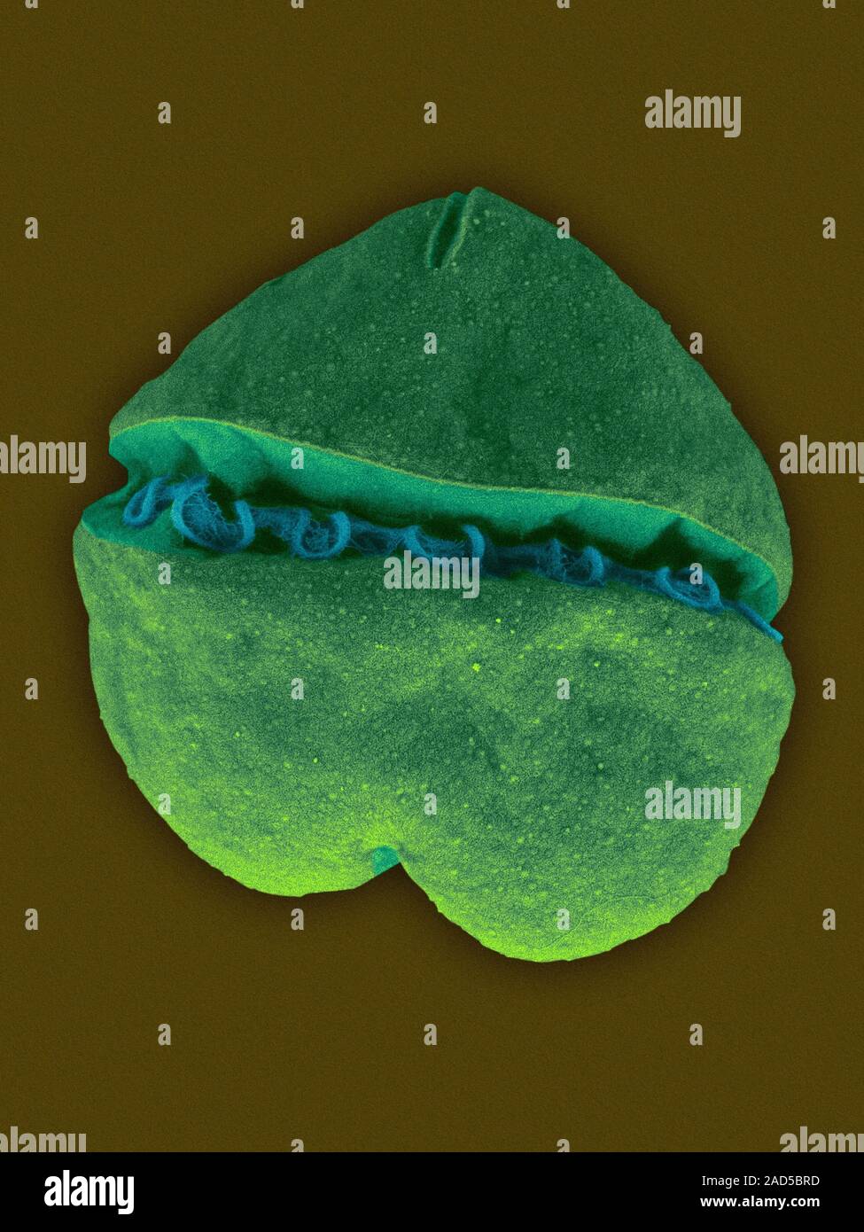 Coloured scanning electron micrograph (SEM) of toxic marine ...