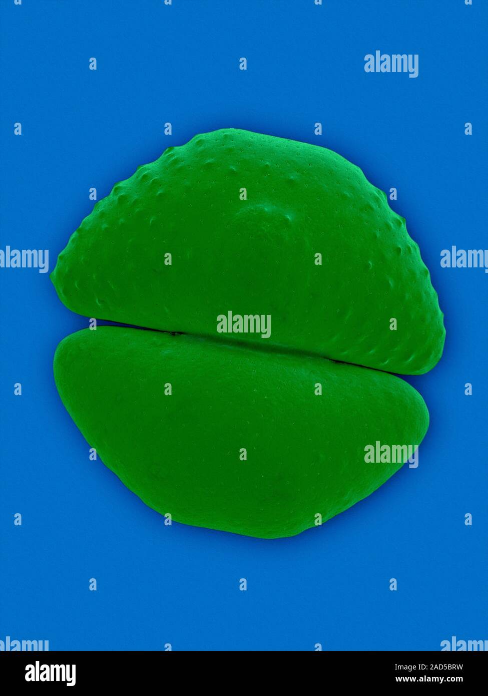 Coloured scanning electron micrograph (SEM) of placoderm desmid ...