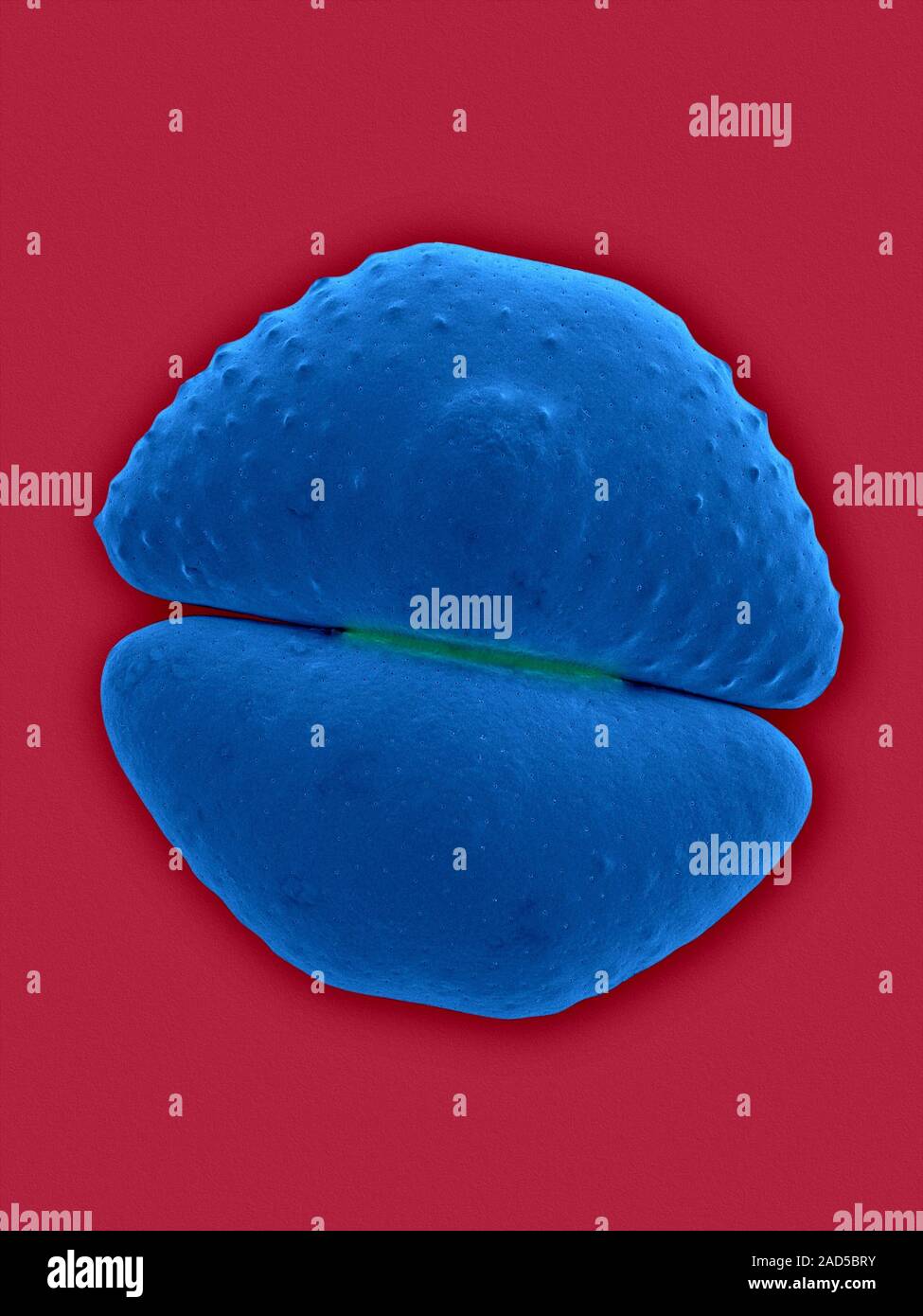 Coloured scanning electron micrograph (SEM) of placoderm desmid ...