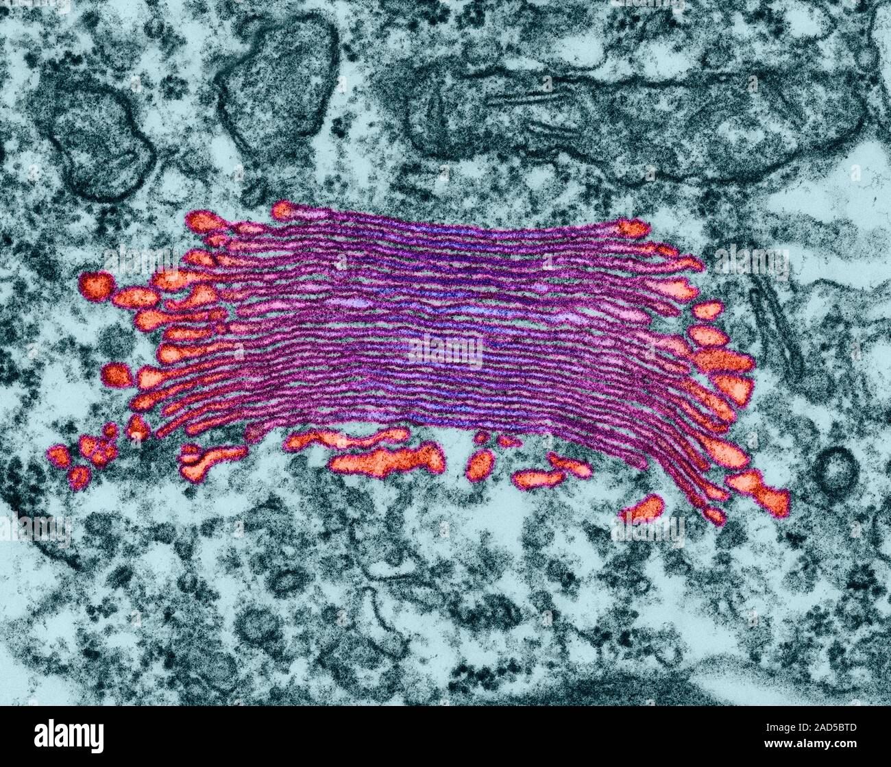 Coloured scanning electron micrograph (TEM) of Golgi apparatus, stacks ...