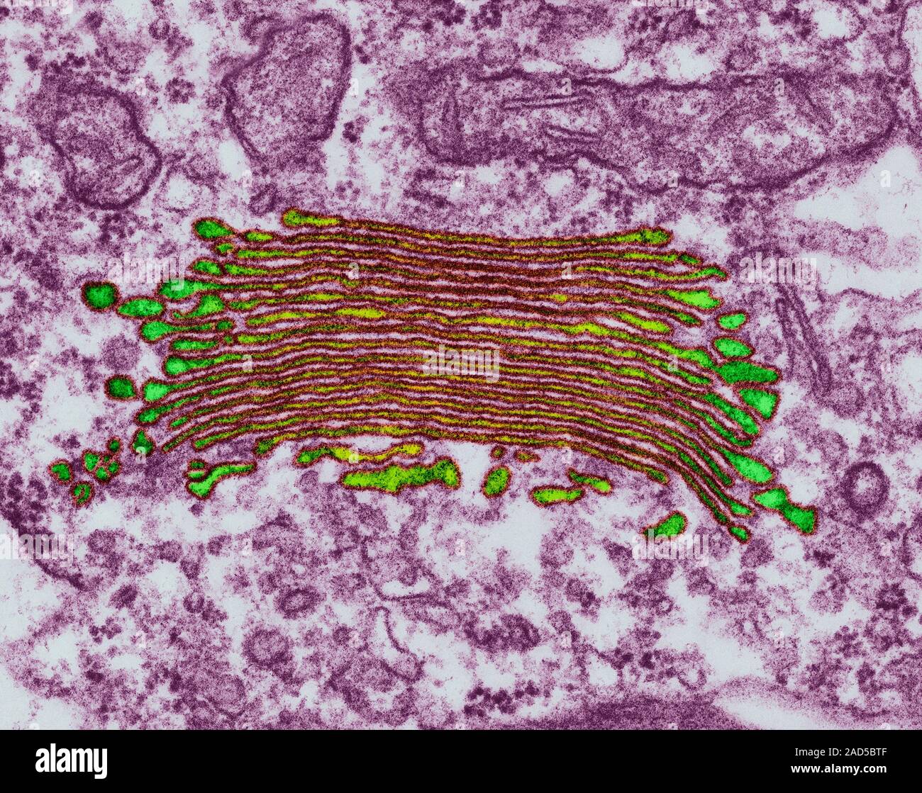 Coloured scanning electron micrograph (TEM) of Golgi apparatus, stacks ...