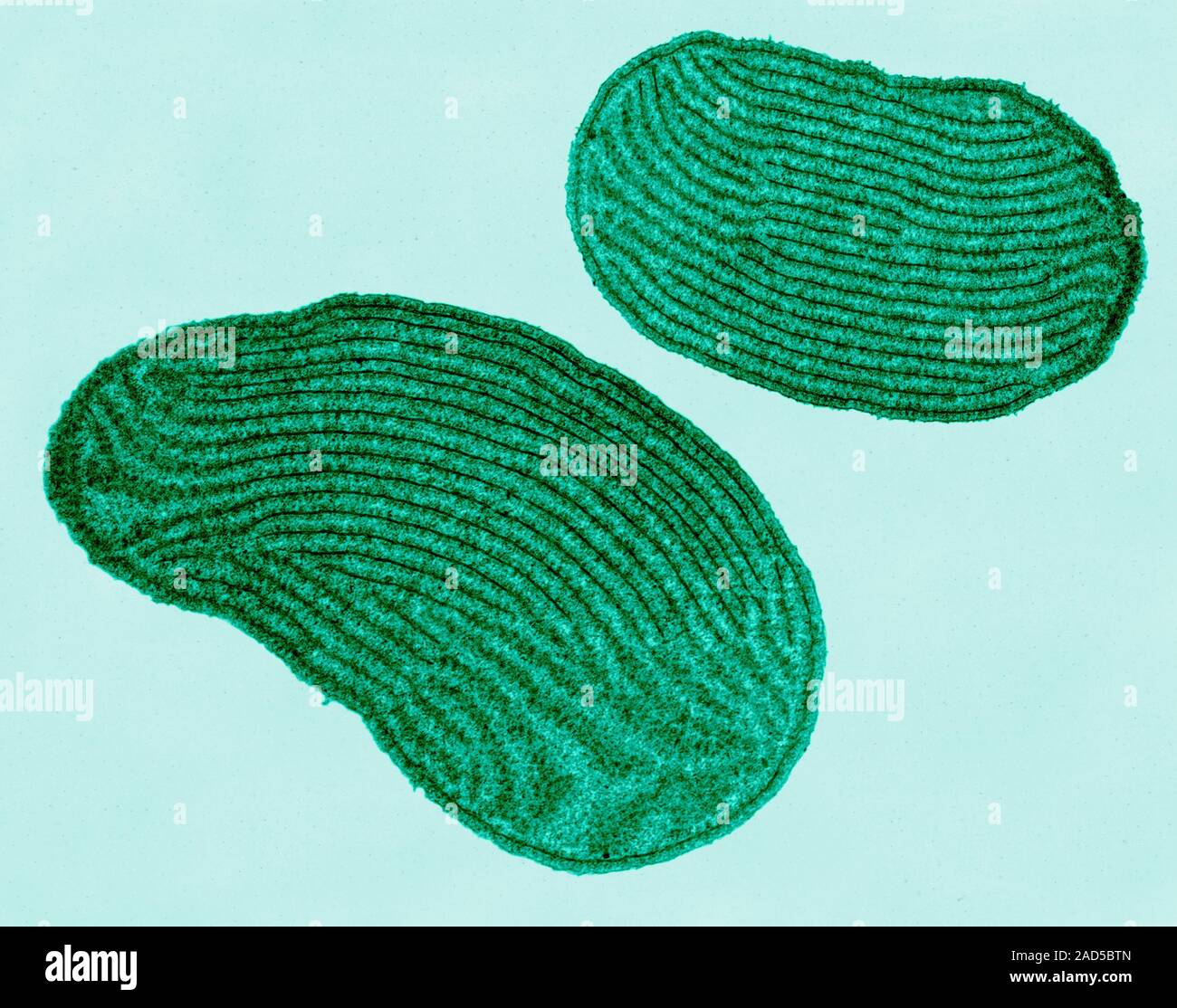 Coloured scanning electron micrograph (TEM) of chloroplasts from a red ...