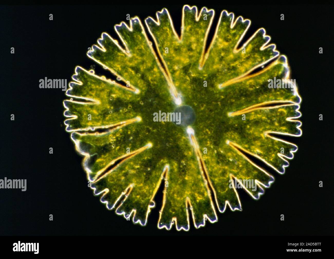 Darkfield light micrograph (LM) of Green alga, desmid (Micrasterias sp ...