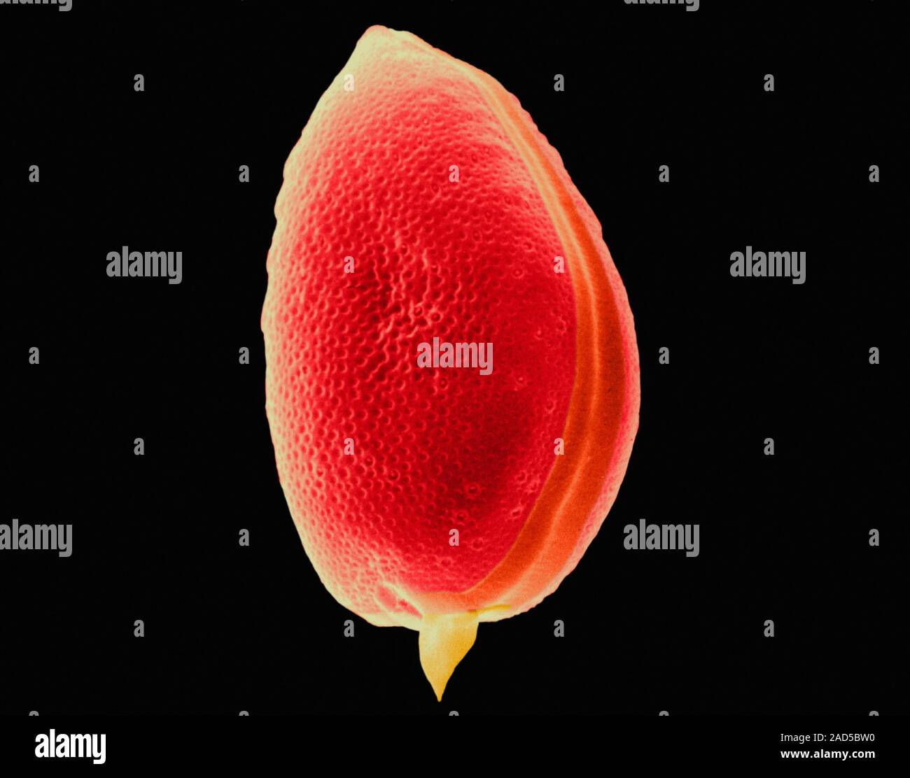 Coloured scanning electron micrograph (SEM) of Prorocentrum micrans ...
