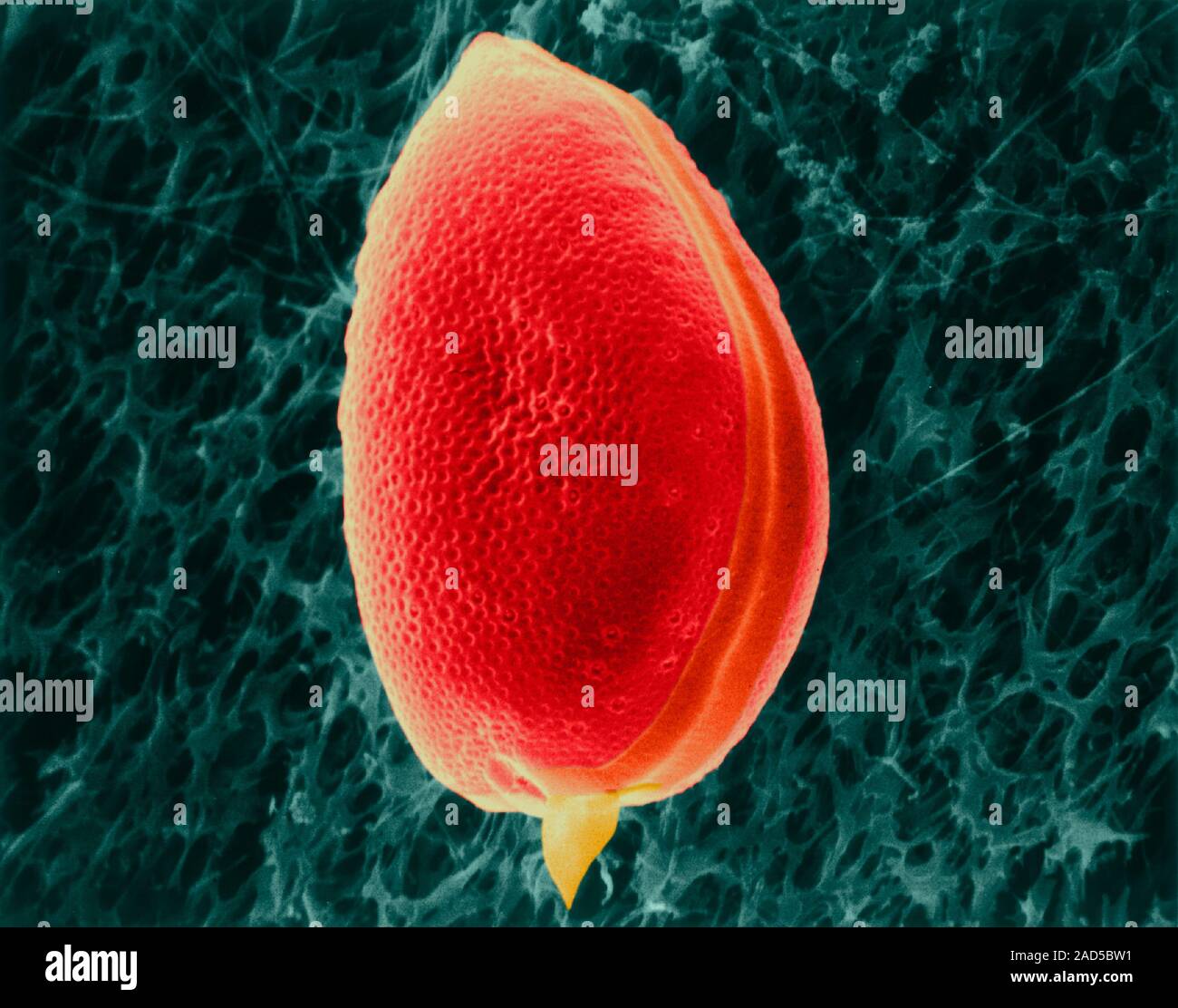 Coloured scanning electron micrograph (SEM) of Prorocentrum micrans ...