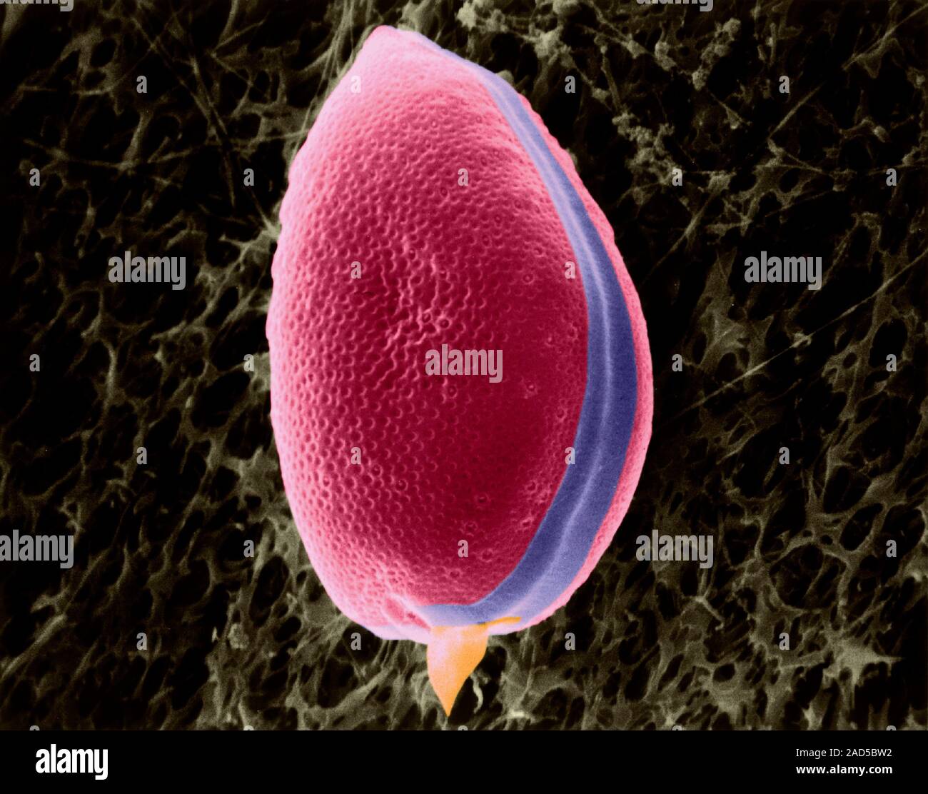 Coloured scanning electron micrograph (SEM) of Prorocentrum micrans ...