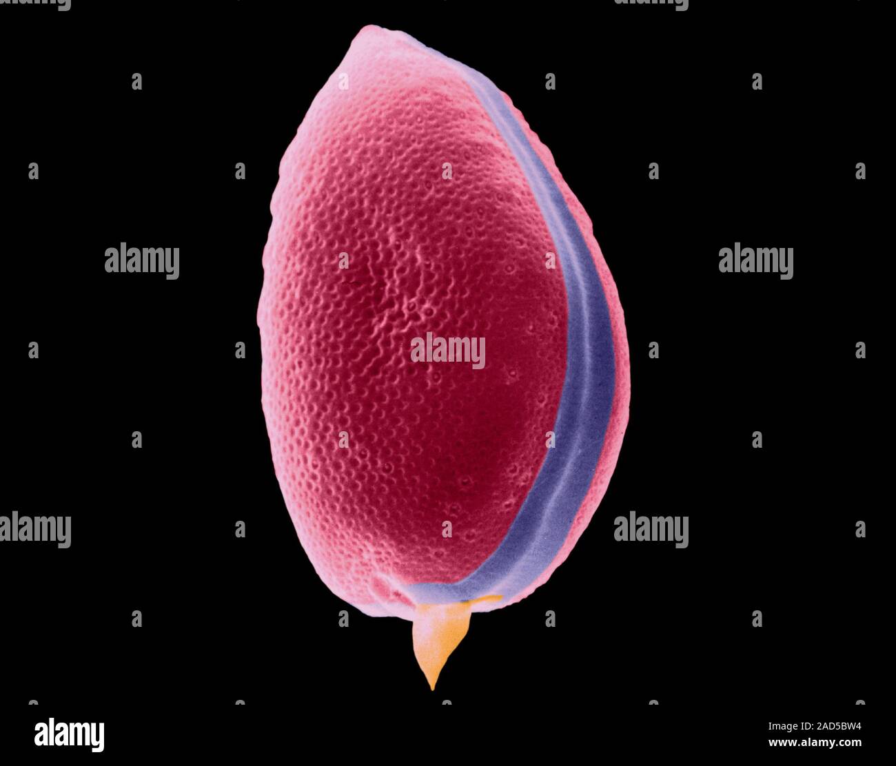 Coloured scanning electron micrograph (SEM) of Prorocentrum micrans ...