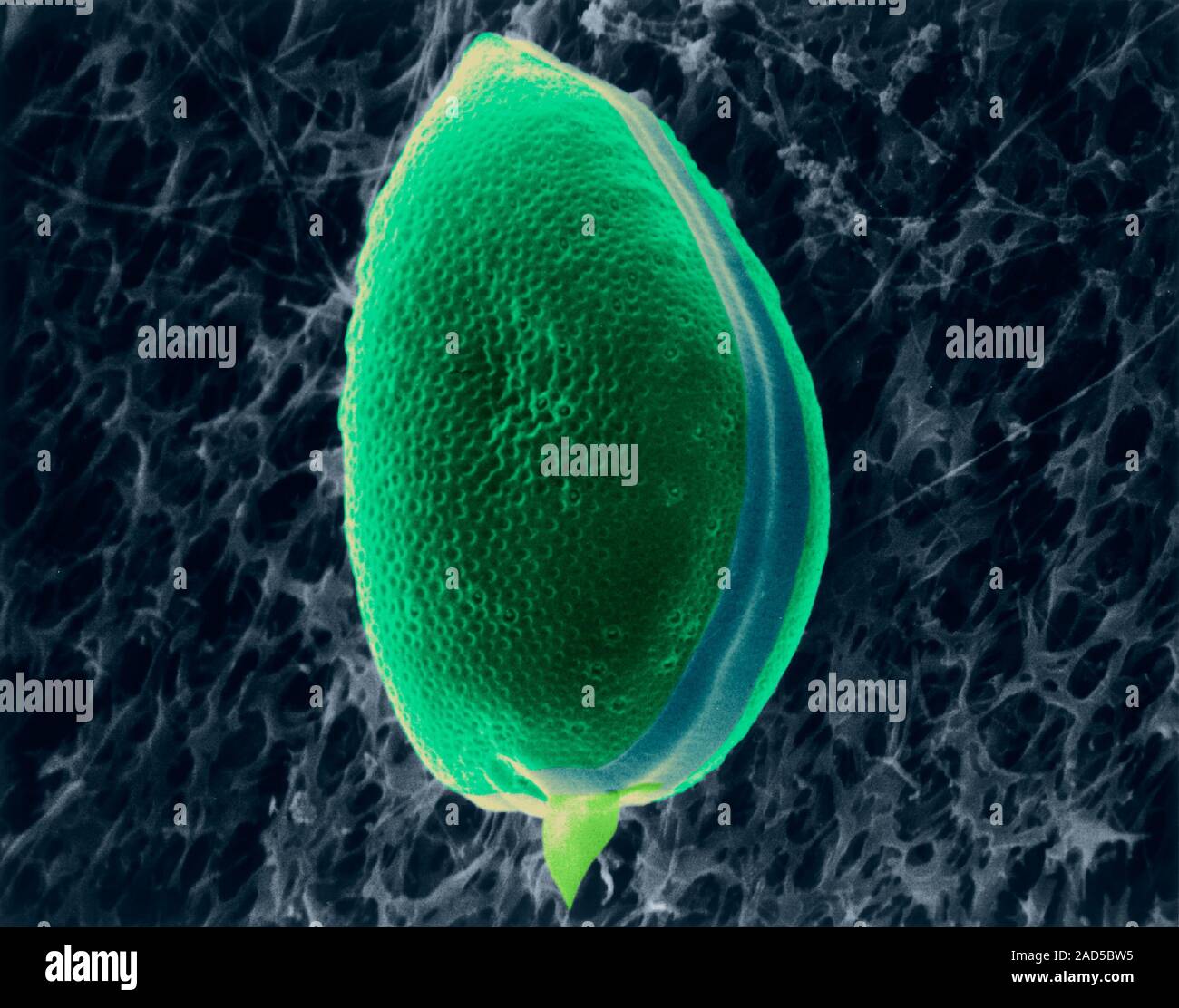 Coloured scanning electron micrograph (SEM) of Prorocentrum micrans ...