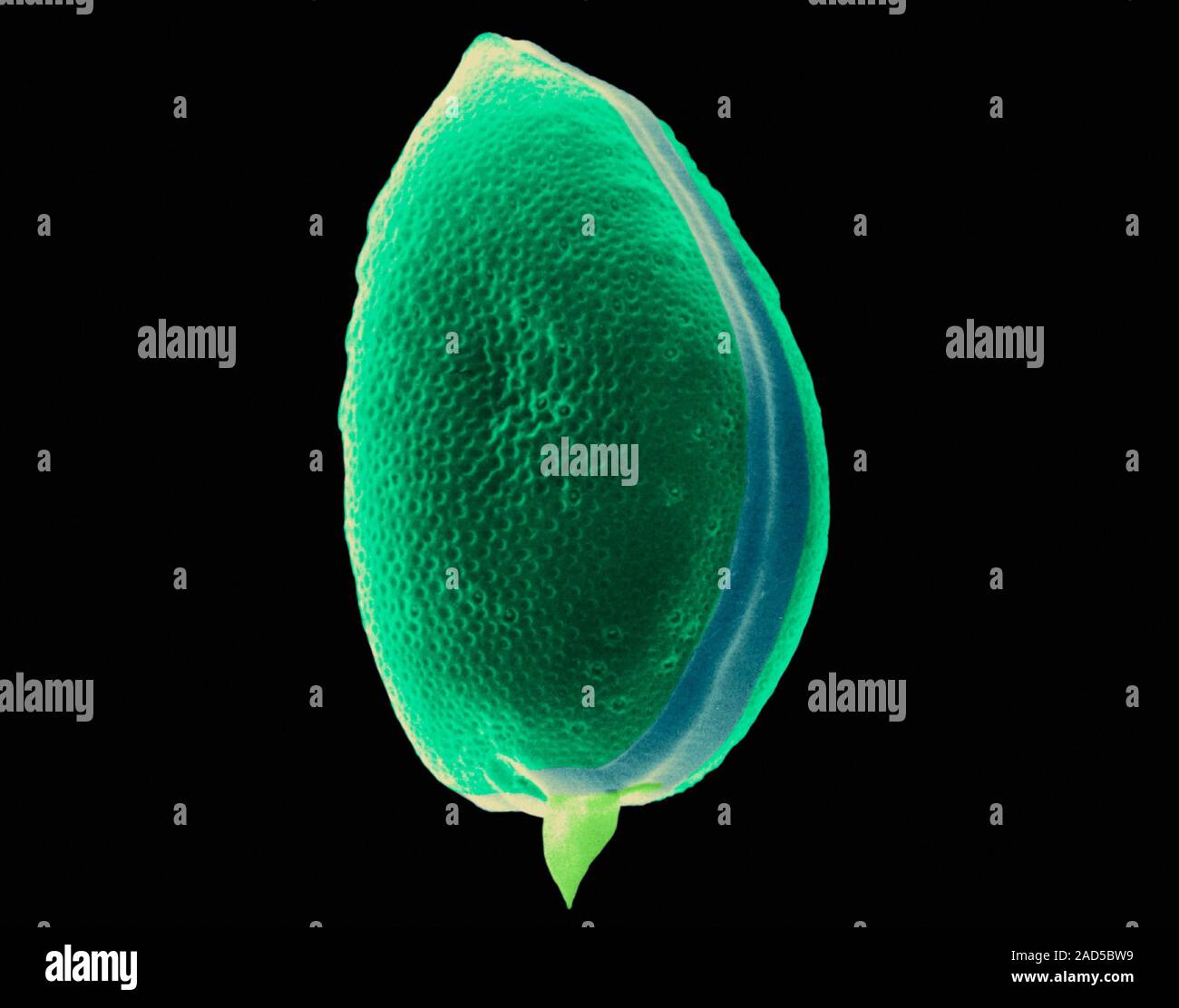 Coloured scanning electron micrograph (SEM) of Prorocentrum micrans ...