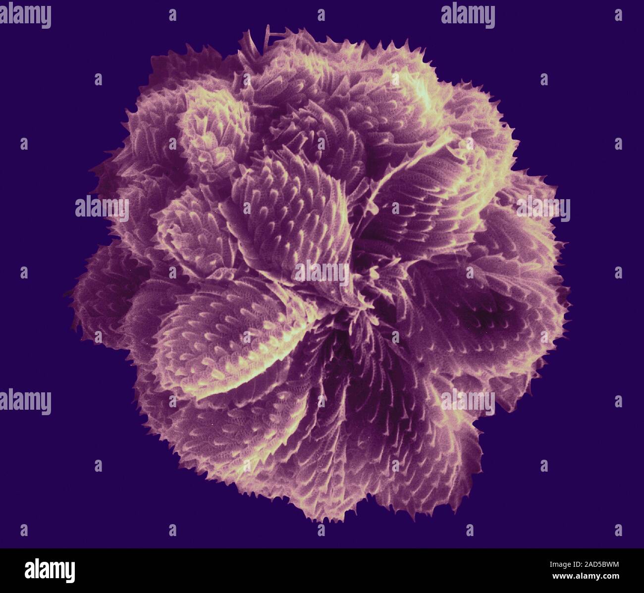 Coloured scanning electron micrograph (SEM) of Synura sp., golden ...