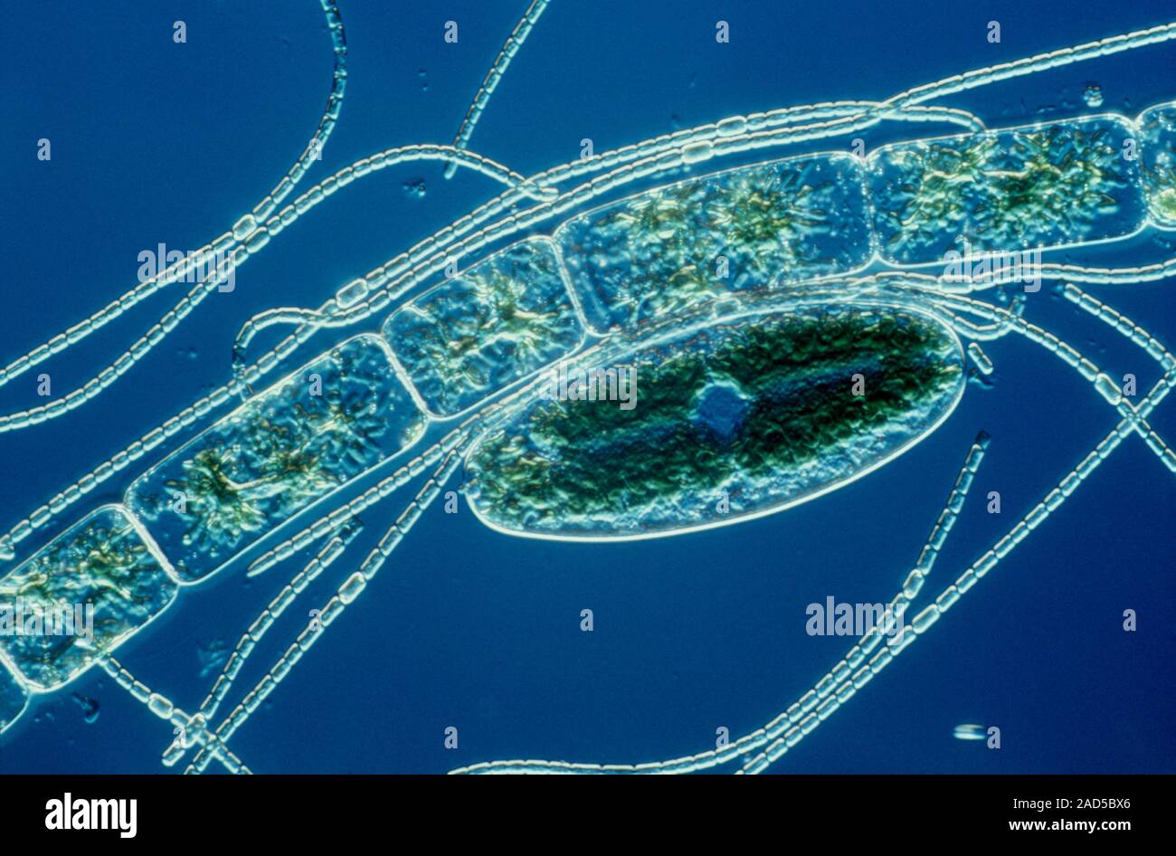 DIC light micrograph (LM) of Light micrograph of a cyanobacterium ...