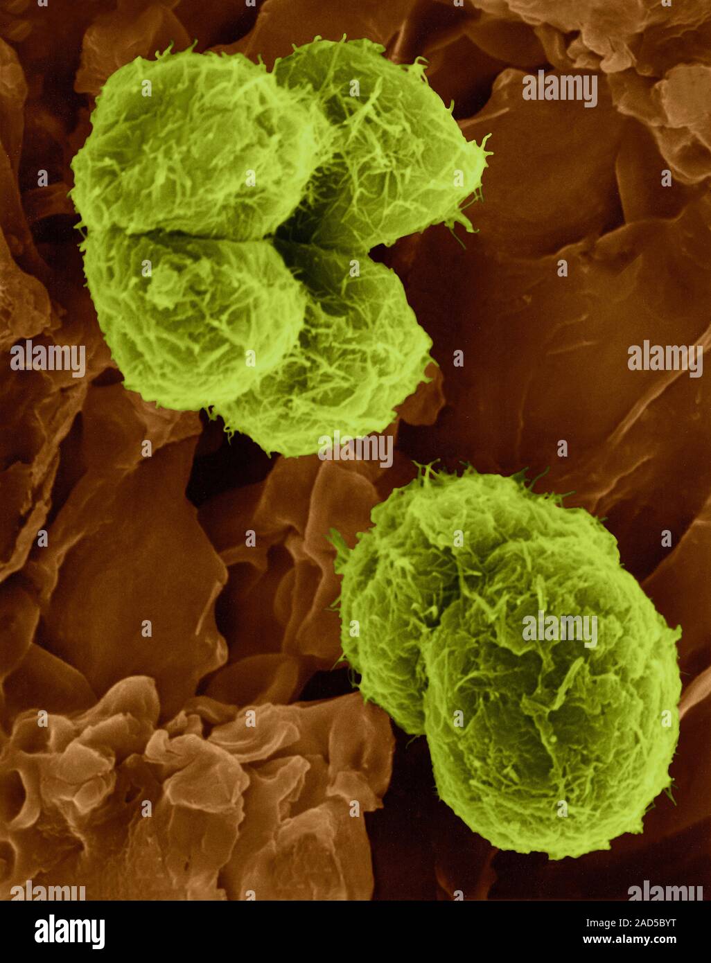 Coloured scanning electron micrograph (SEM) of green alga (chlorophyte ...