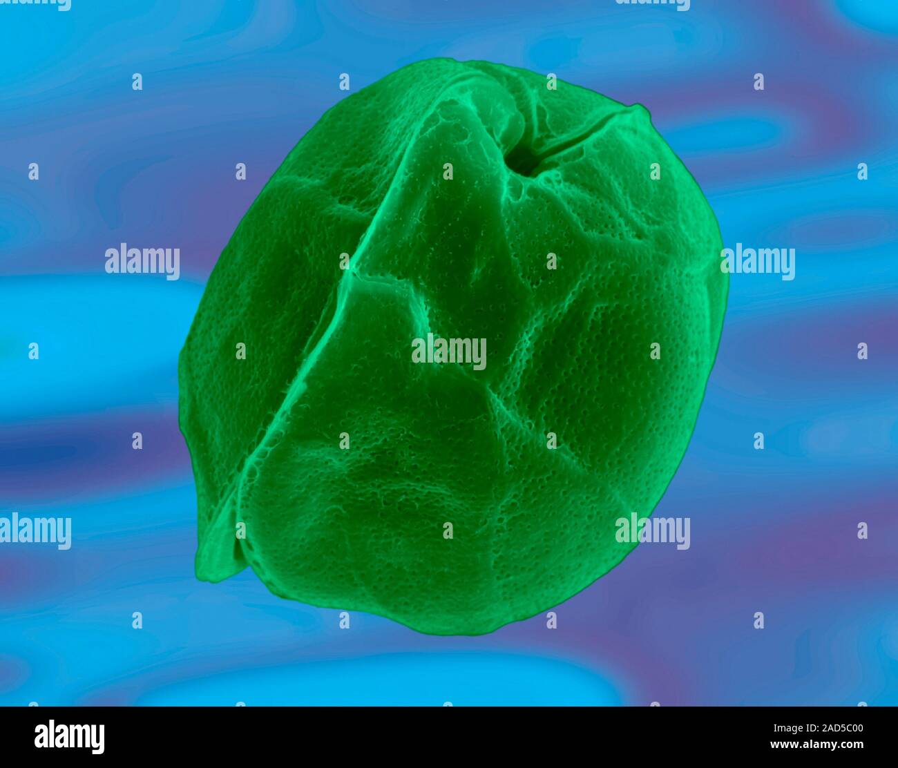 Coloured scanning electron micrograph (SEM) of Gambierdiscus toxicus is ...