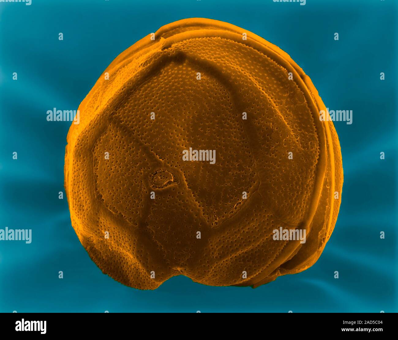 Coloured scanning electron micrograph (SEM) of Gambierdiscus toxicus is ...
