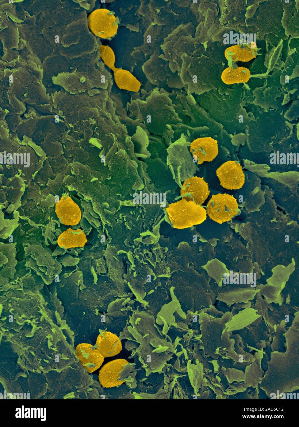 Coloured scanning electron micrograph (SEM) of Coal degrading archaea ...