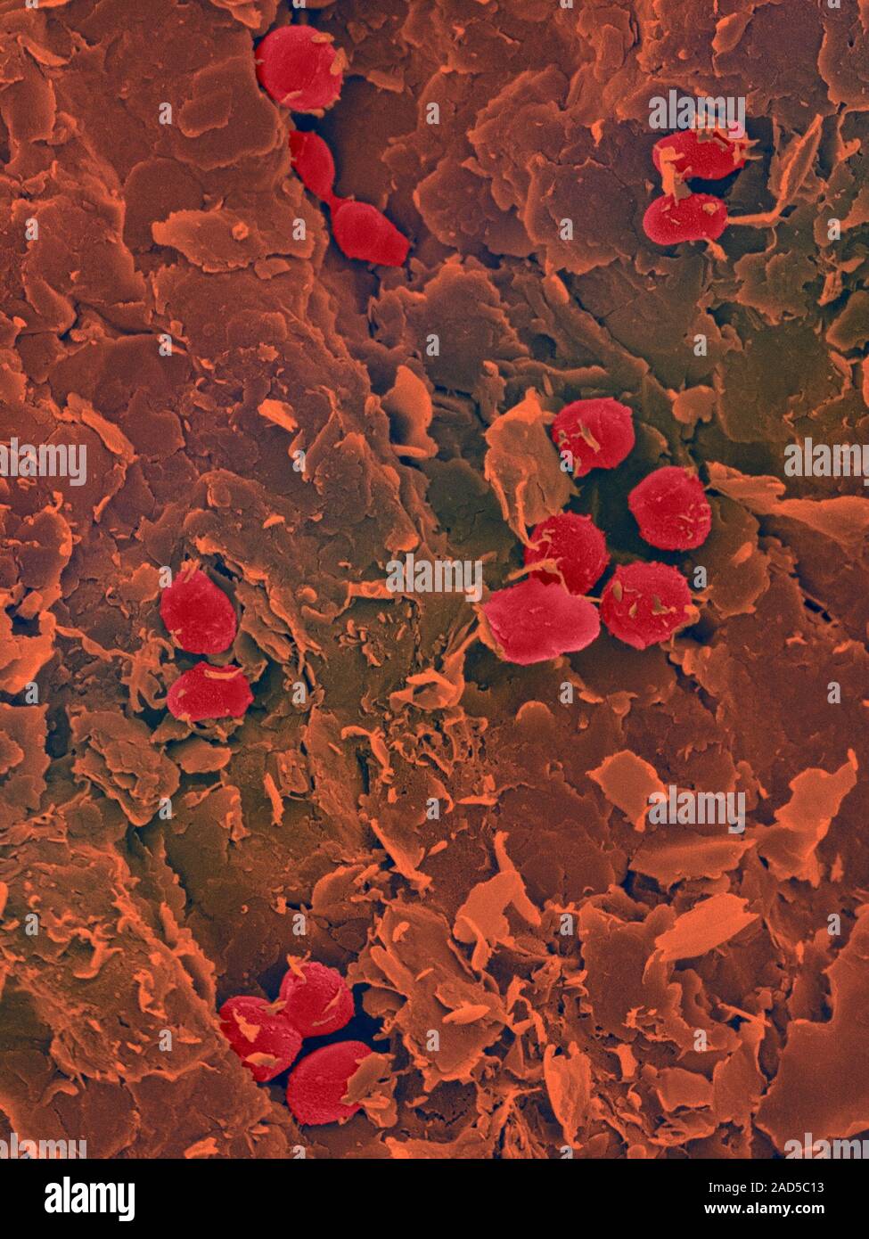 Coloured scanning electron micrograph (SEM) of Coal degrading archaea ...