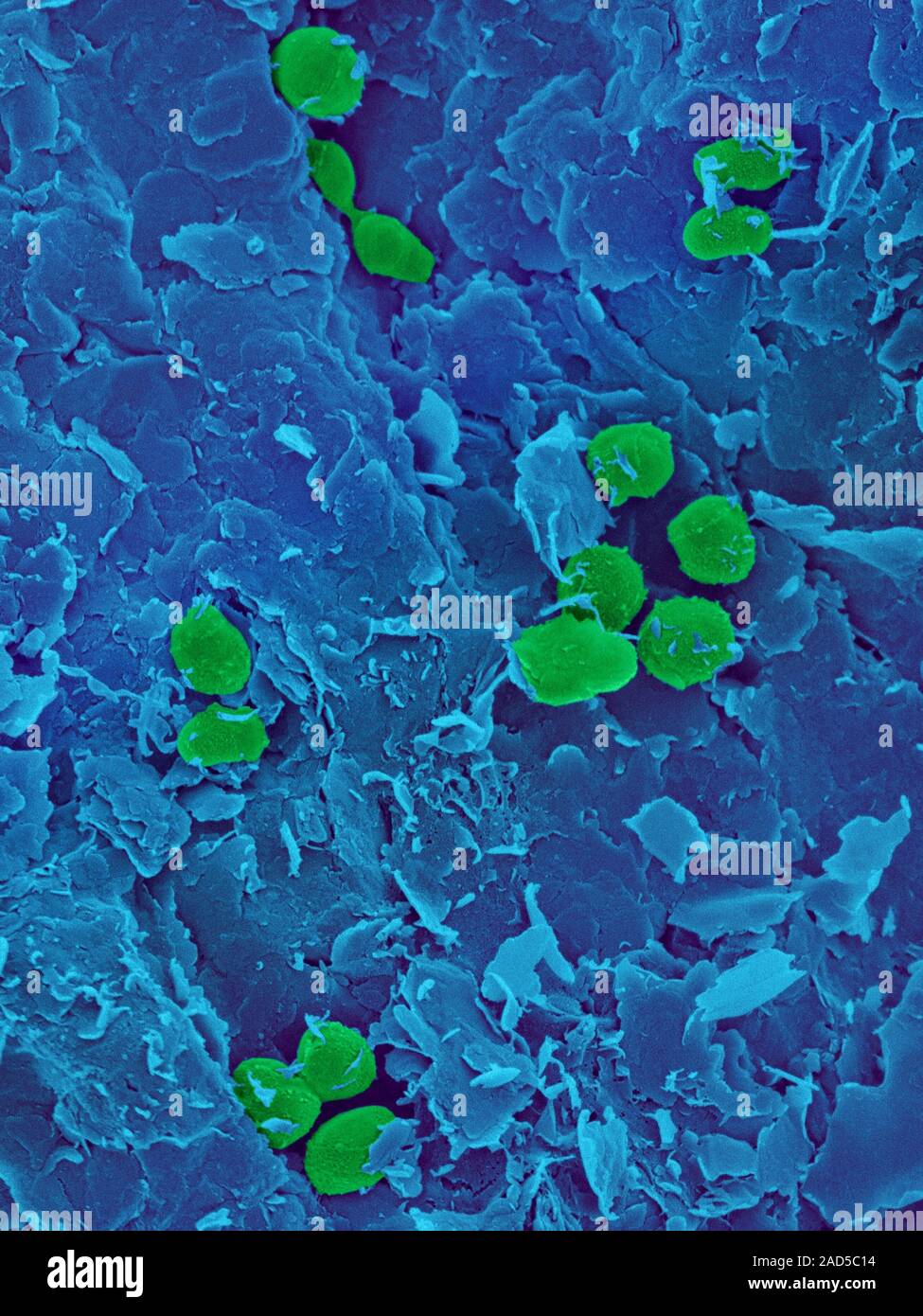 Coloured scanning electron micrograph (SEM) of Coal degrading archaea ...