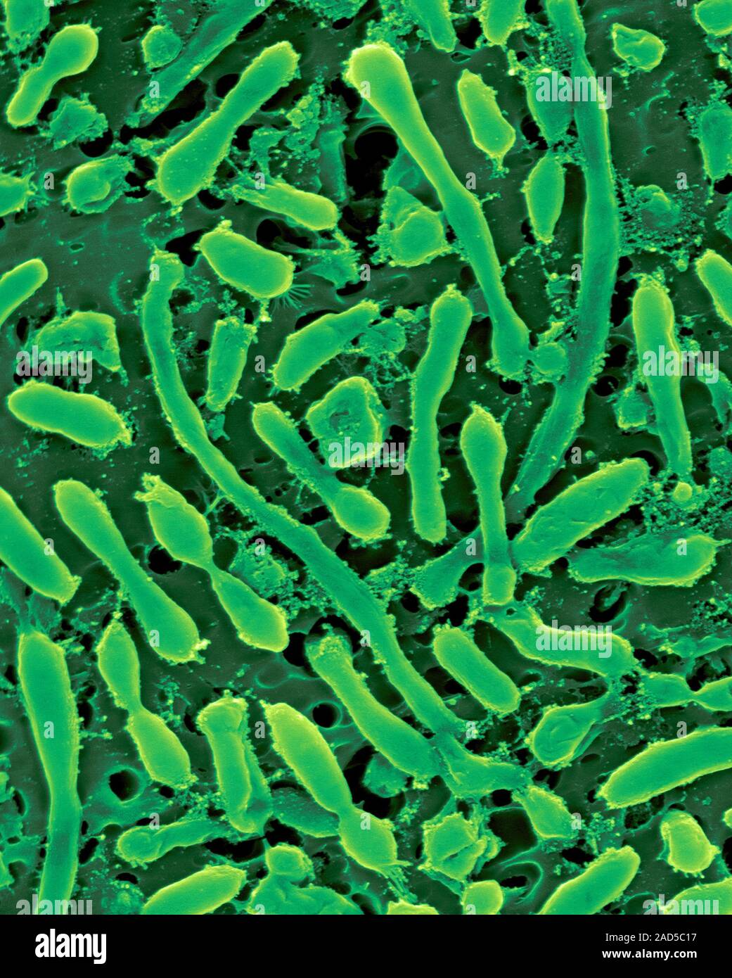 Coloured scanning electron micrograph (SEM) of Halophilic archaea ...