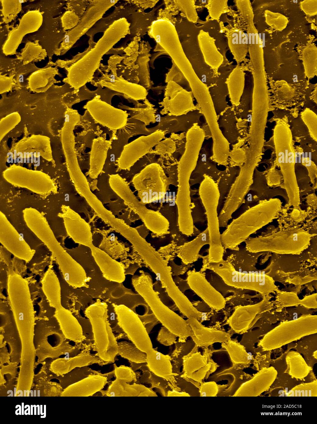Coloured scanning electron micrograph (SEM) of Halophilic archaea ...