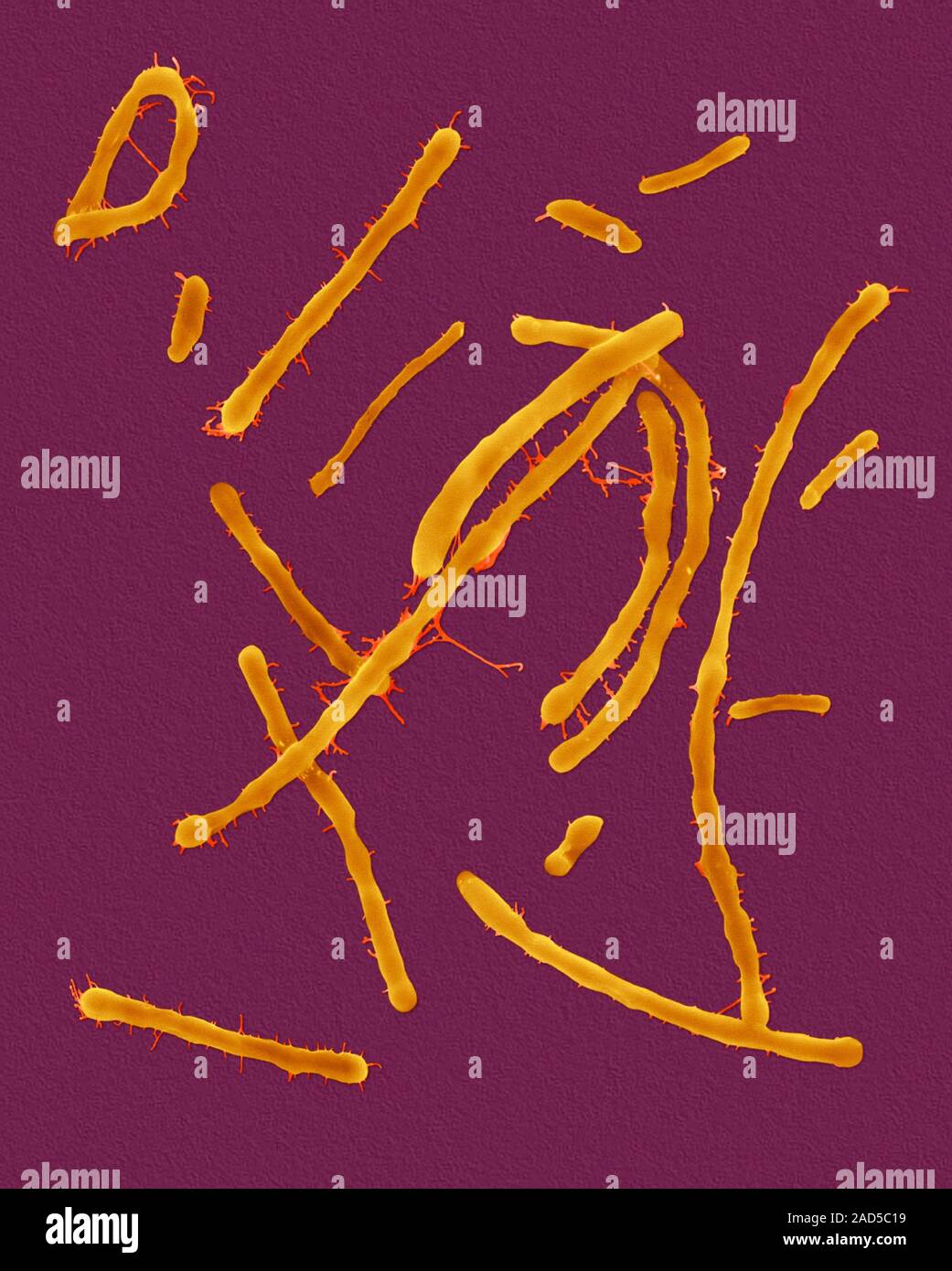 Coloured scanning electron micrograph (SEM) of Halobacterium sp. is a ...