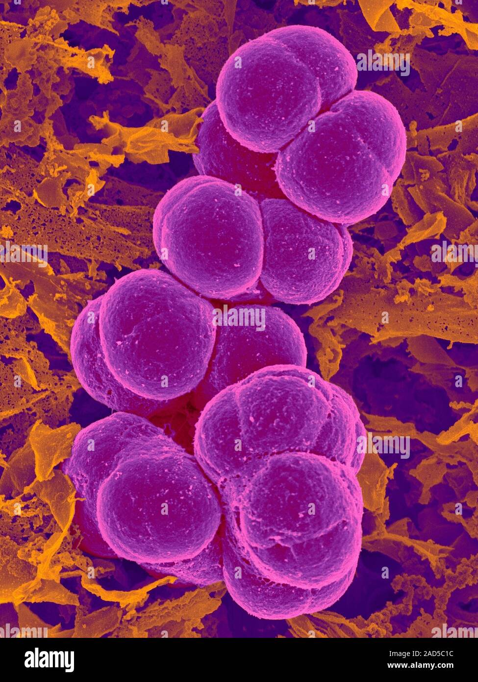 Archaebacteria Methanogens