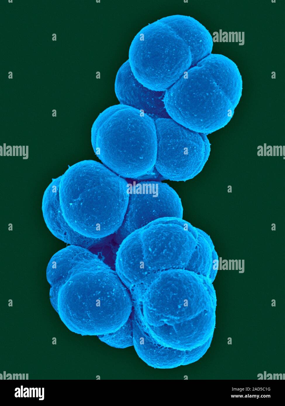 Coloured scanning electron micrograph (SEM) of Methanosarcina barkeri ...