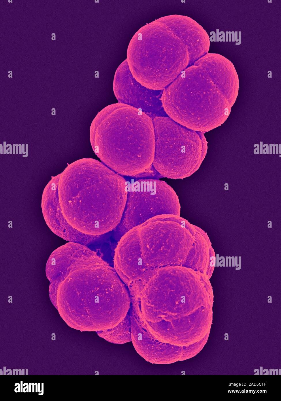 Coloured scanning electron micrograph (SEM) of Methanosarcina barkeri ...