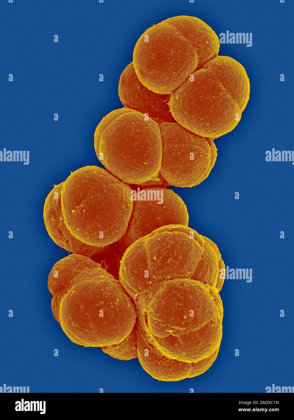 Coloured scanning electron micrograph (SEM) of Methanosarcina barkeri ...