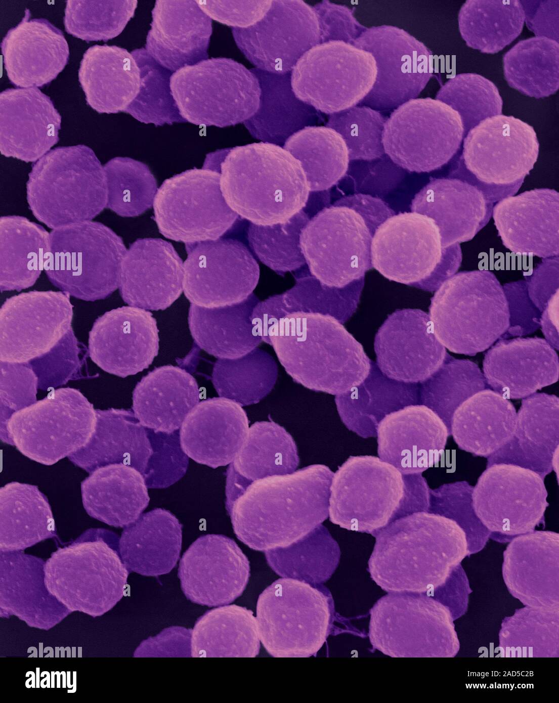 Coloured scanning electron micrograph (SEM) of Methanococcus jannaschii ...