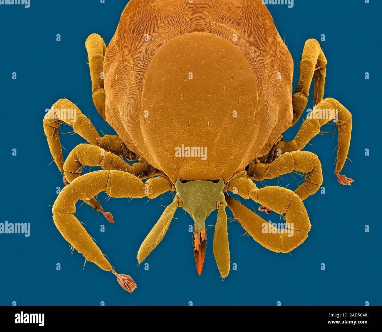Coloured scanning electron micrograph (SEM) of Deer tick (Ixodes ...