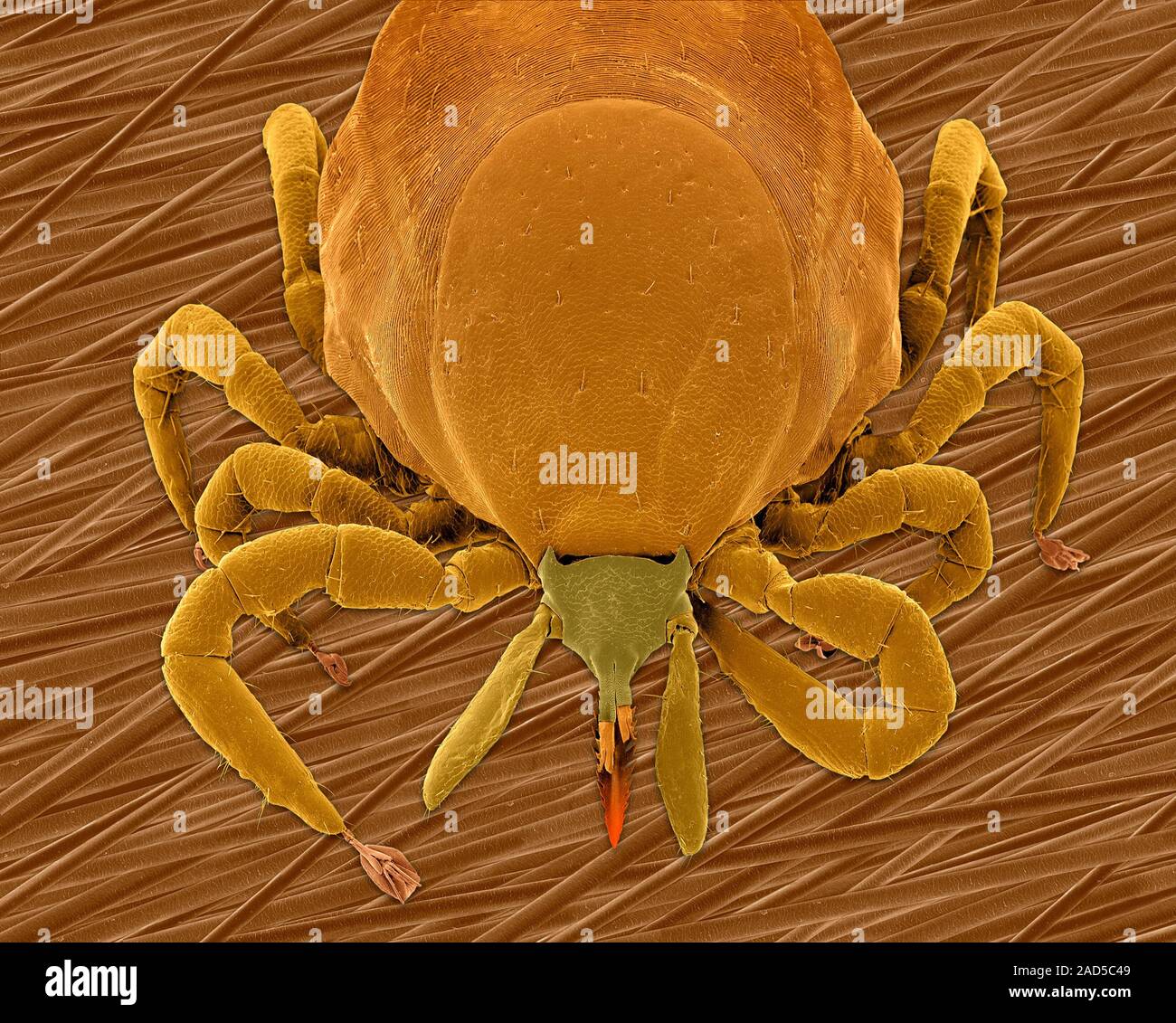 Coloured scanning electron micrograph (SEM) of Deer tick (Ixodes ...