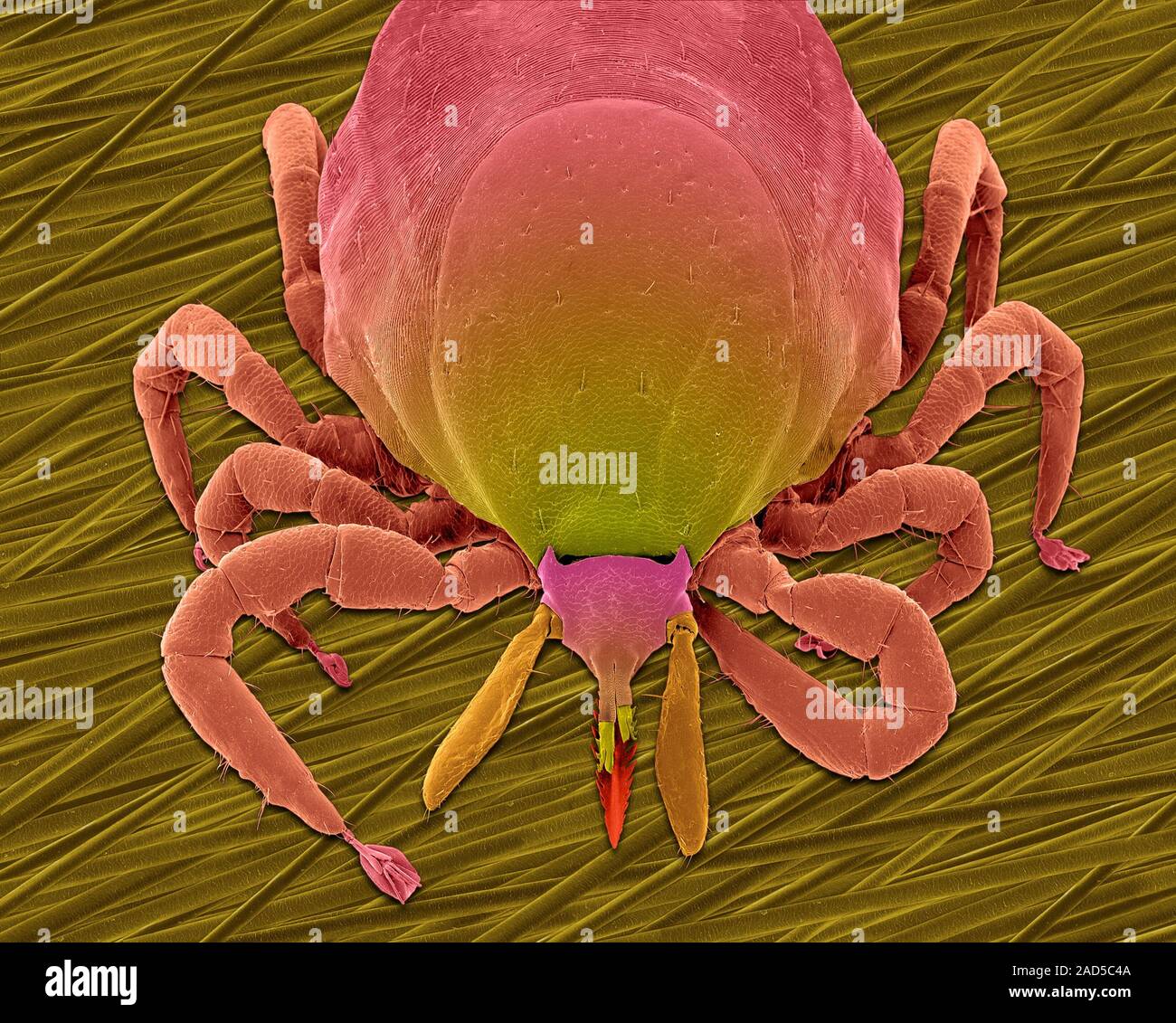 Coloured scanning electron micrograph (SEM) of Deer tick (Ixodes ...
