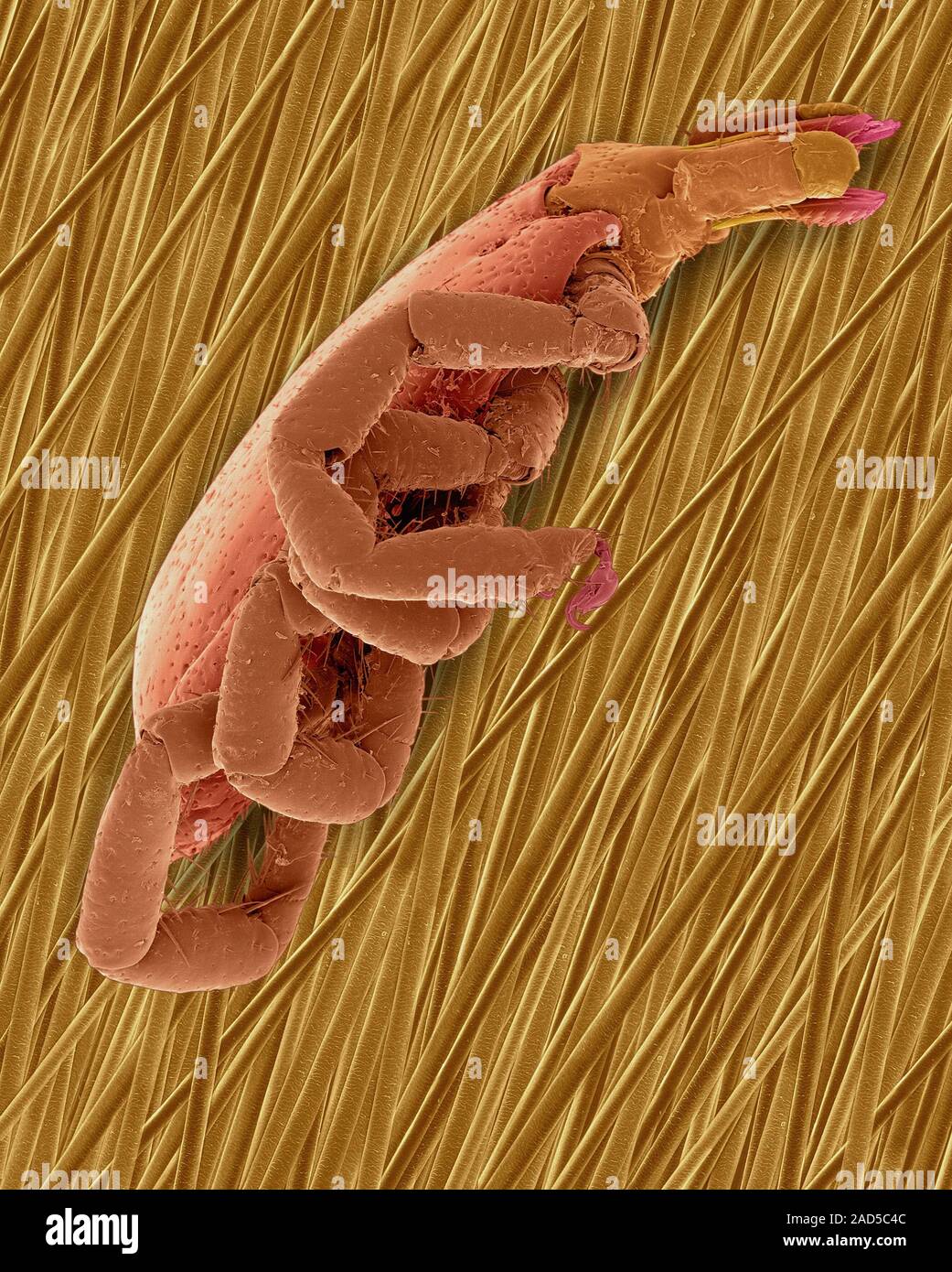 Coloured scanning electron micrograph (SEM) of American dog tick ...