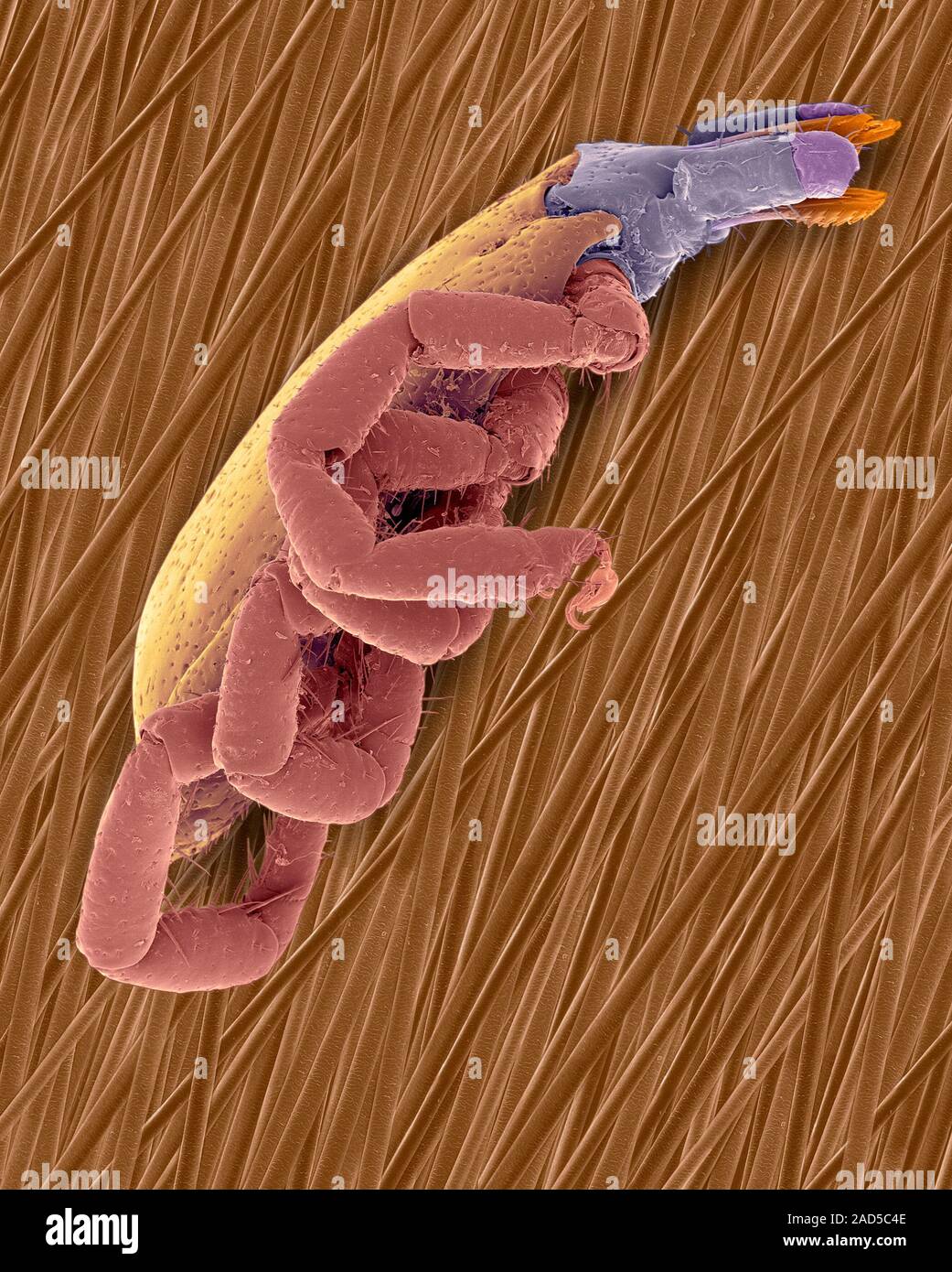 Coloured scanning electron micrograph (SEM) of American dog tick ...