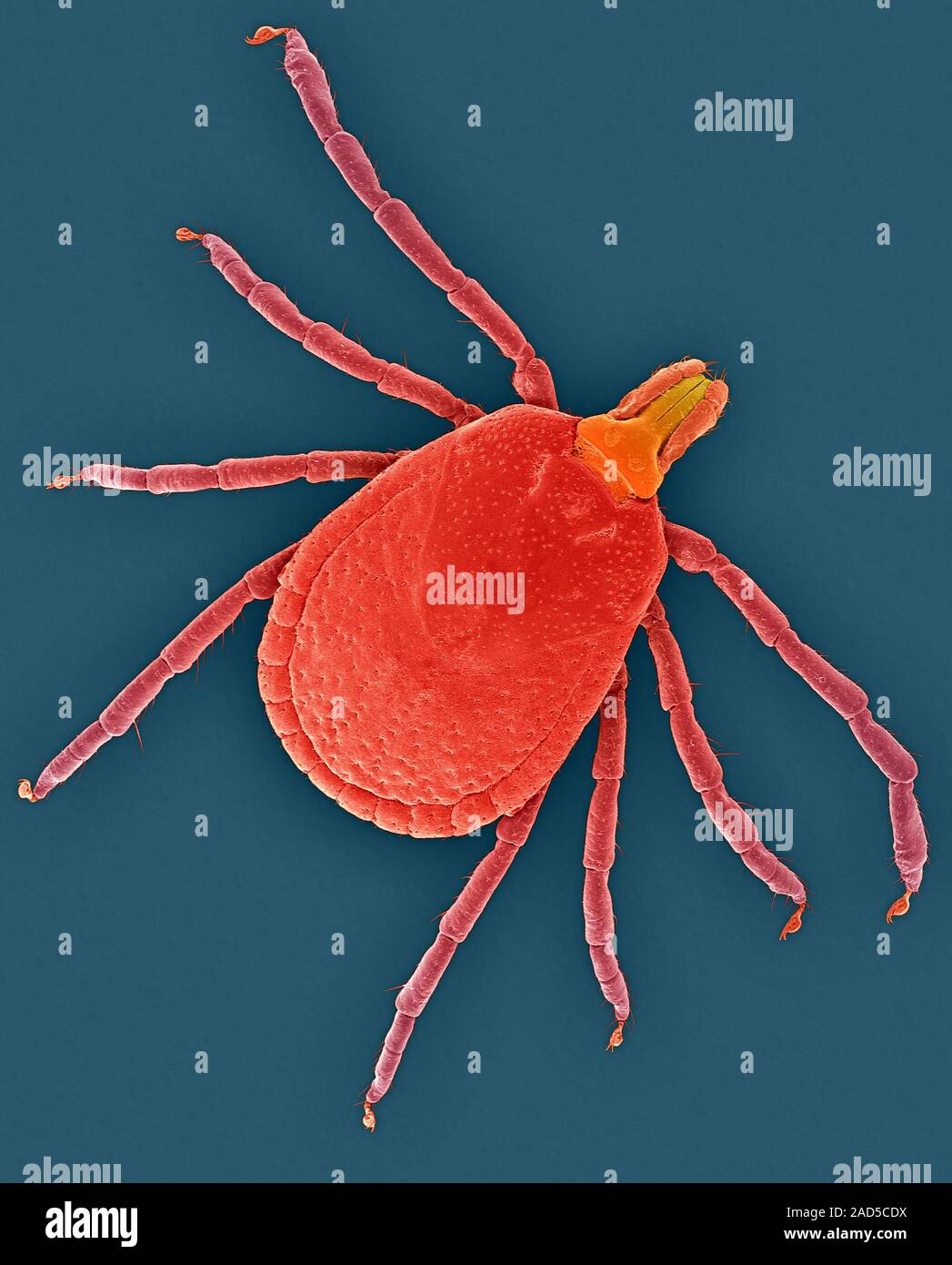 Coloured scanning electron micrograph (SEM) of Lone star tick ...