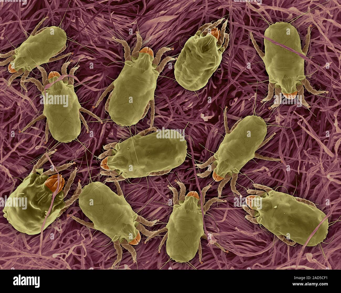 Coloured scanning electron micrograph (SEM) of Photocomposite of dust ...
