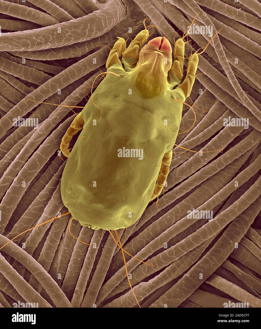 Coloured scanning electron micrograph (SEM) of Dust mite ...
