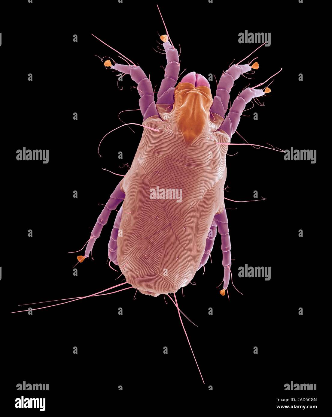 Coloured scanning electron micrograph (SEM) of Dust mite ...