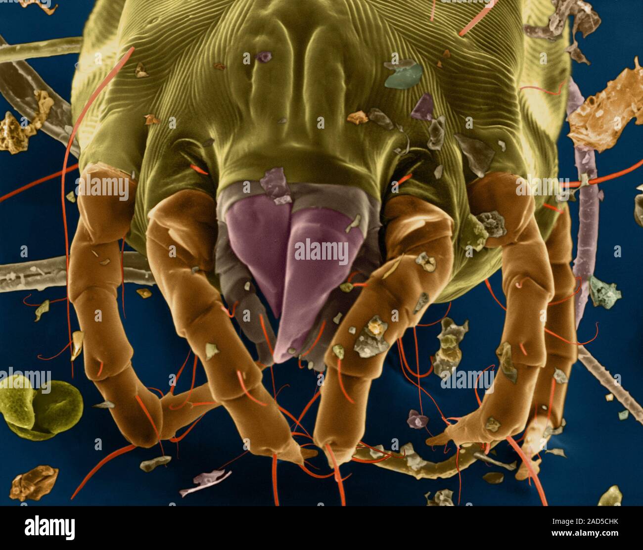 Coloured scanning electron micrograph (SEM) of Dust mite head and ...