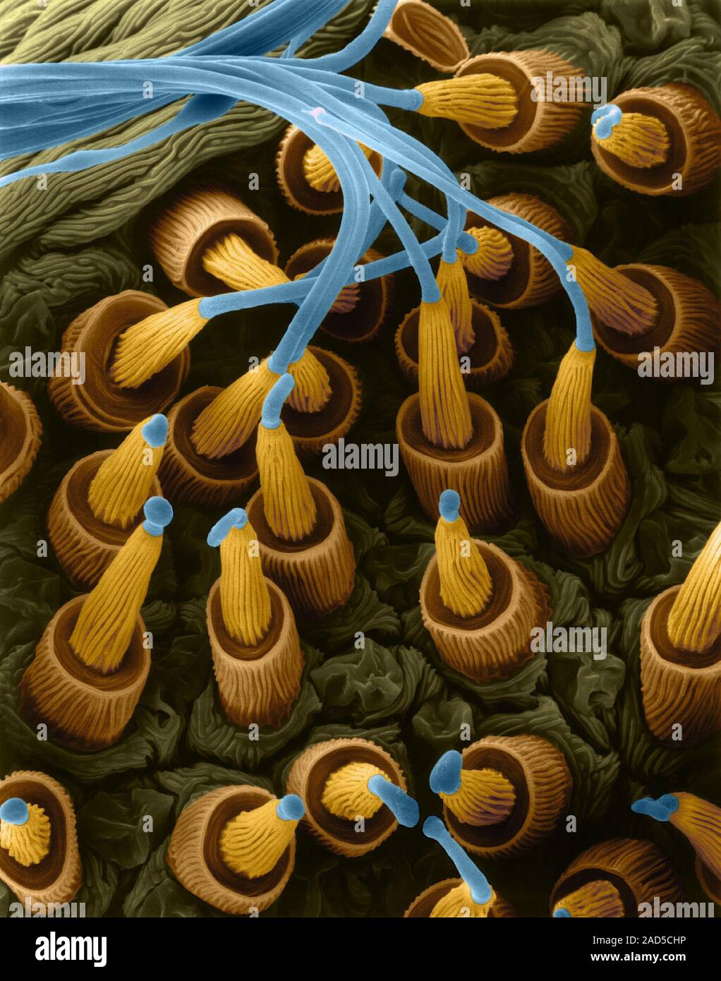 Coloured scanning electron micrograph (SEM) of Spiny-back (orb weaver ...