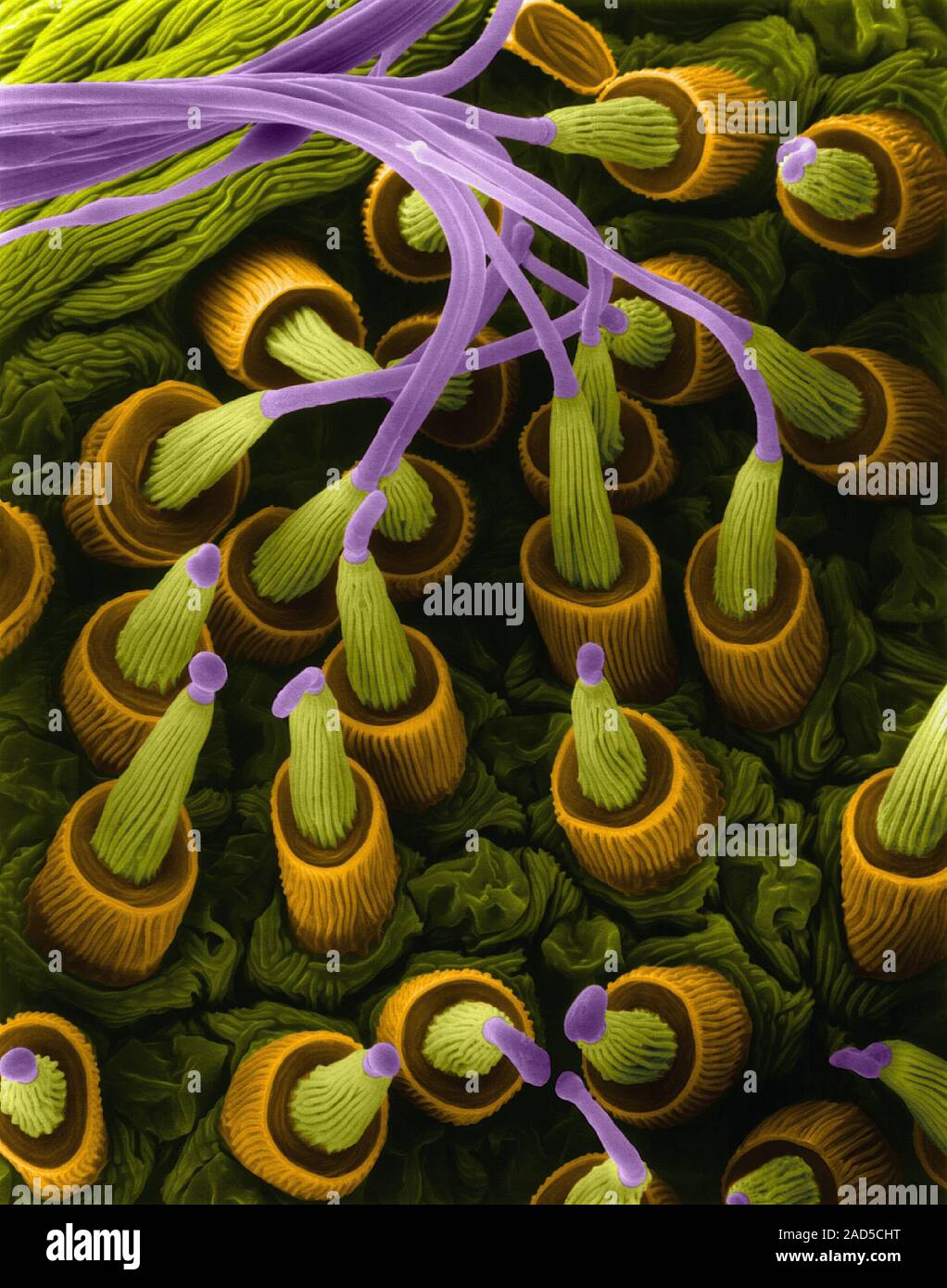 Coloured scanning electron micrograph (SEM) of Spiny-back (orb weaver ...