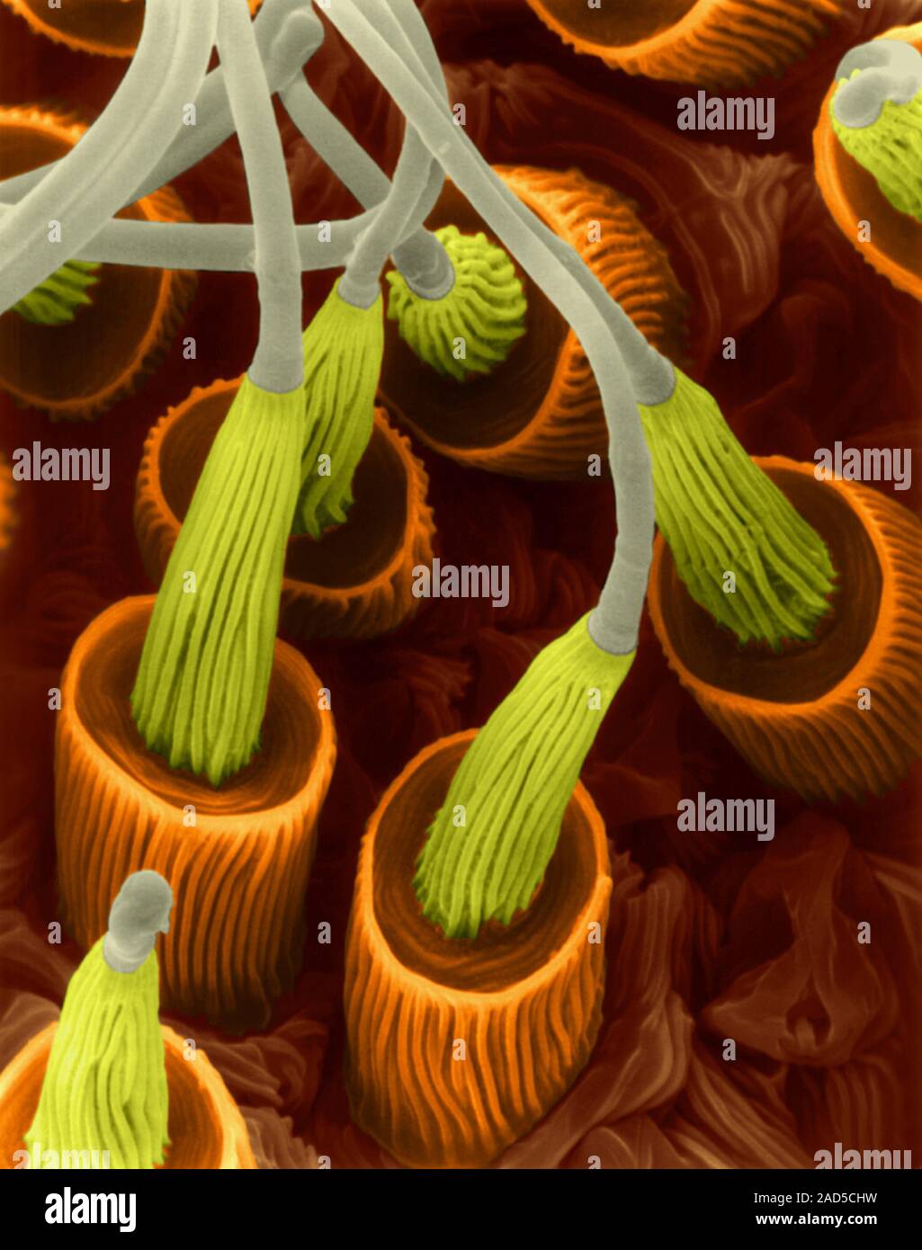 Coloured scanning electron micrograph (SEM) of Spiny-backed (orb weaver ...