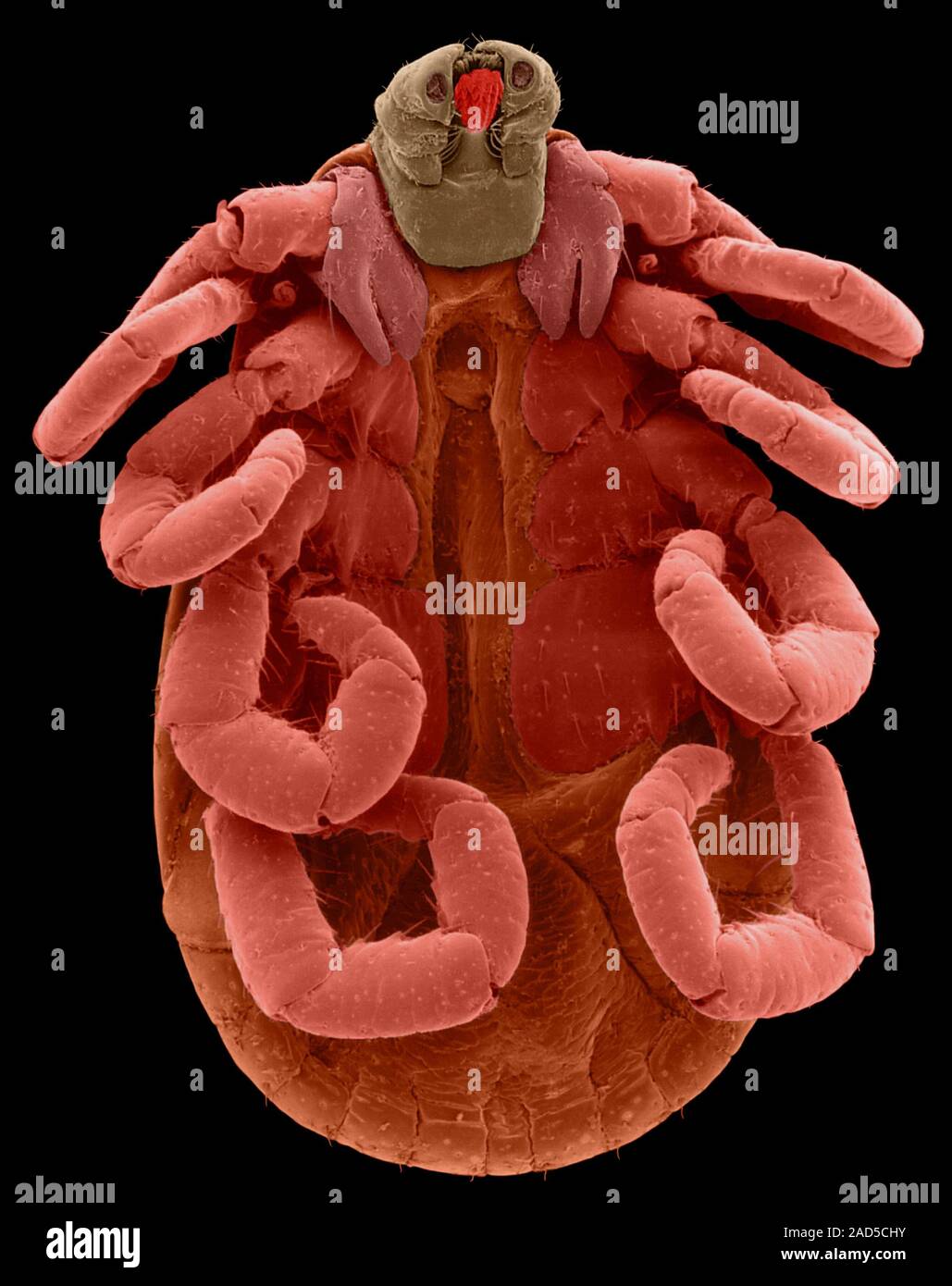 Coloured scanning electron micrograph (SEM) of American dog tick ...