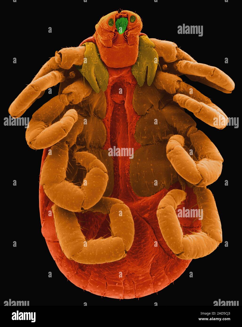 Coloured scanning electron micrograph (SEM) of American dog tick ...