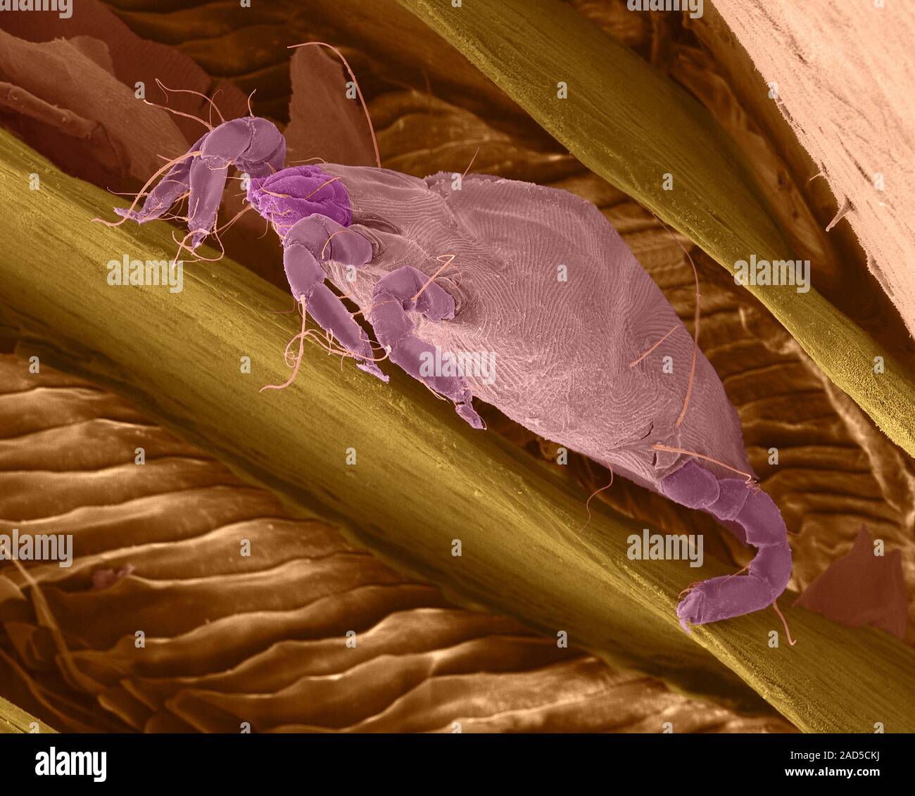 Coloured scanning electron micrograph (SEM) of Bird mite (Ornithonyssus ...