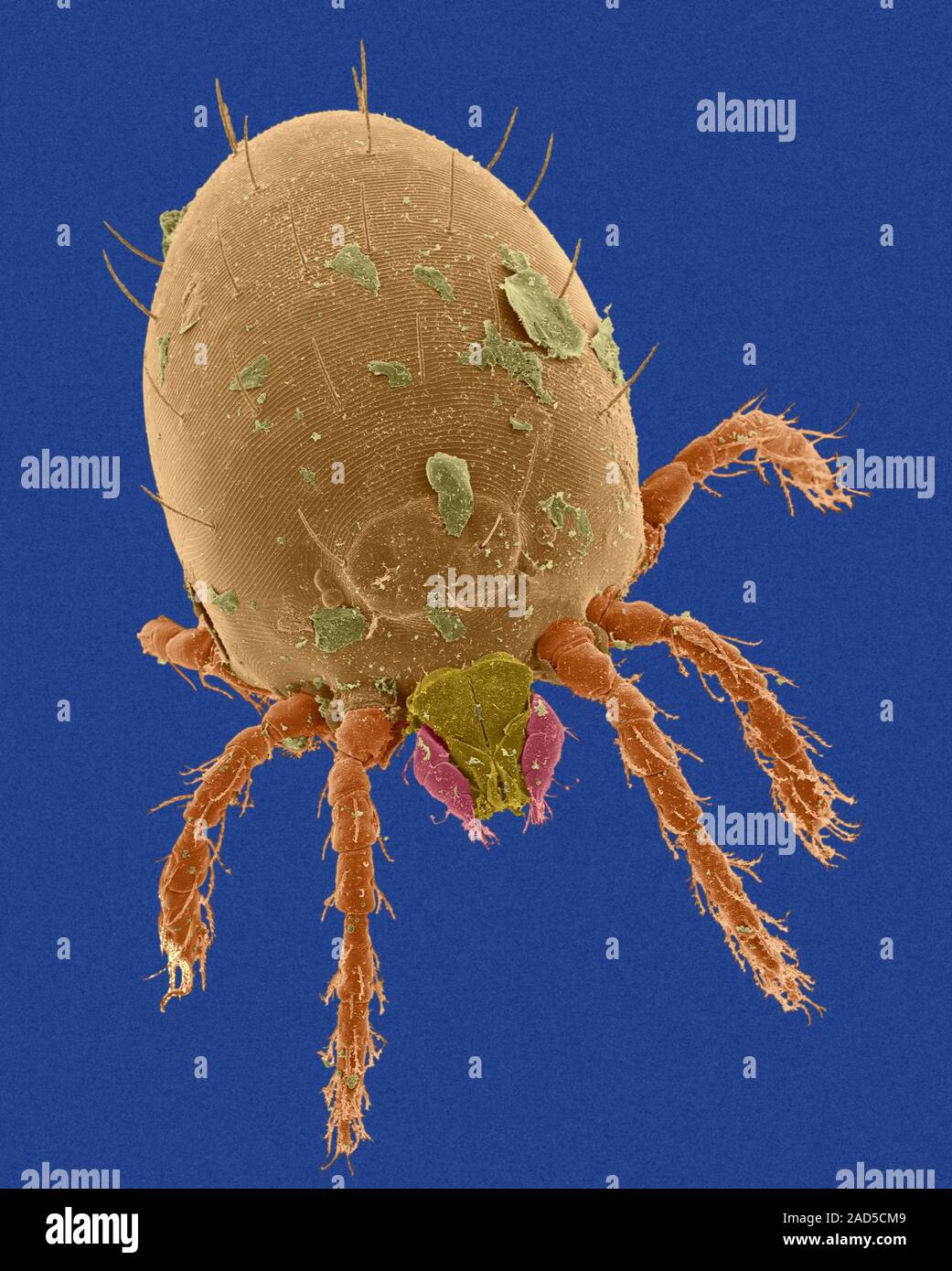 Coloured scanning electron micrograph (SEM) of Chigger (harvest mite ...